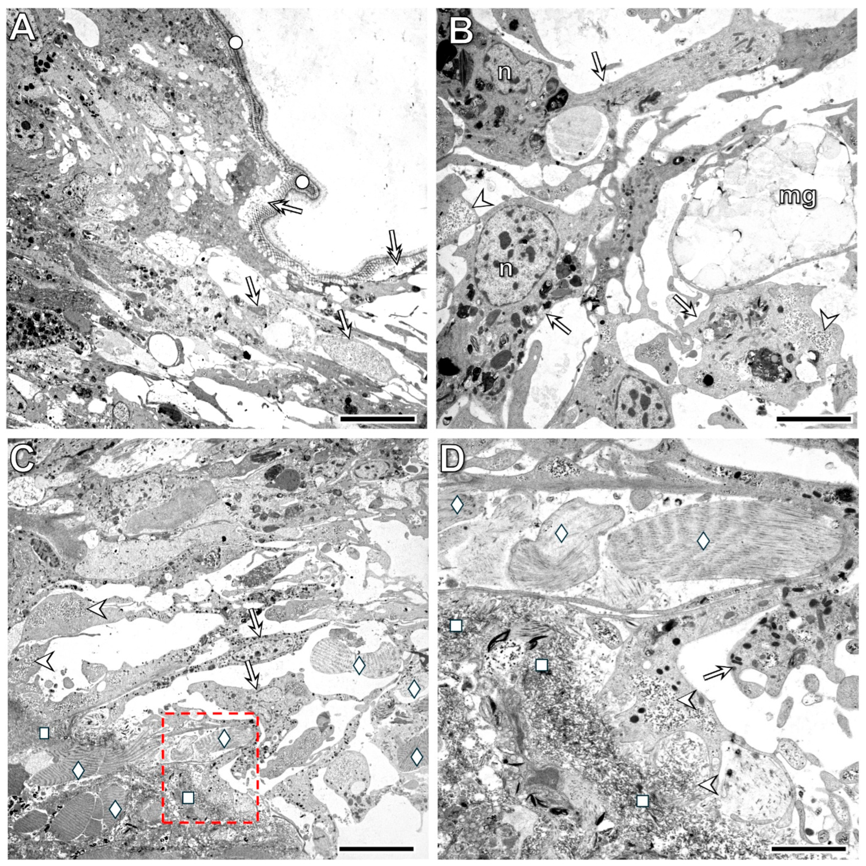 Segment Regeneration of an Earthworm I: Formation of the Body Wall ...