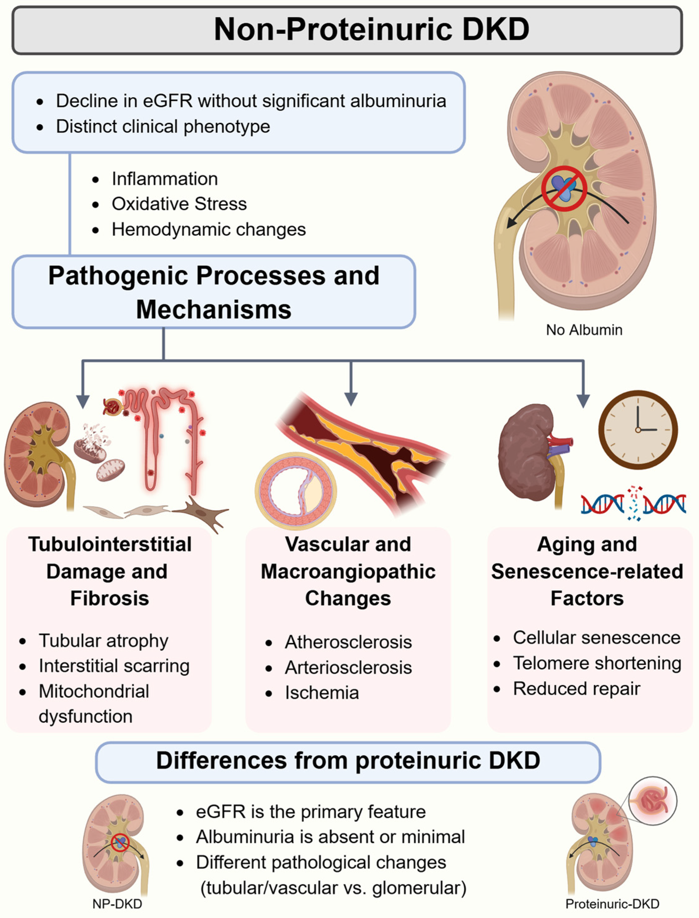 Non-Proteinuric Diabetic Kidney Disease: A Comprehensive Review