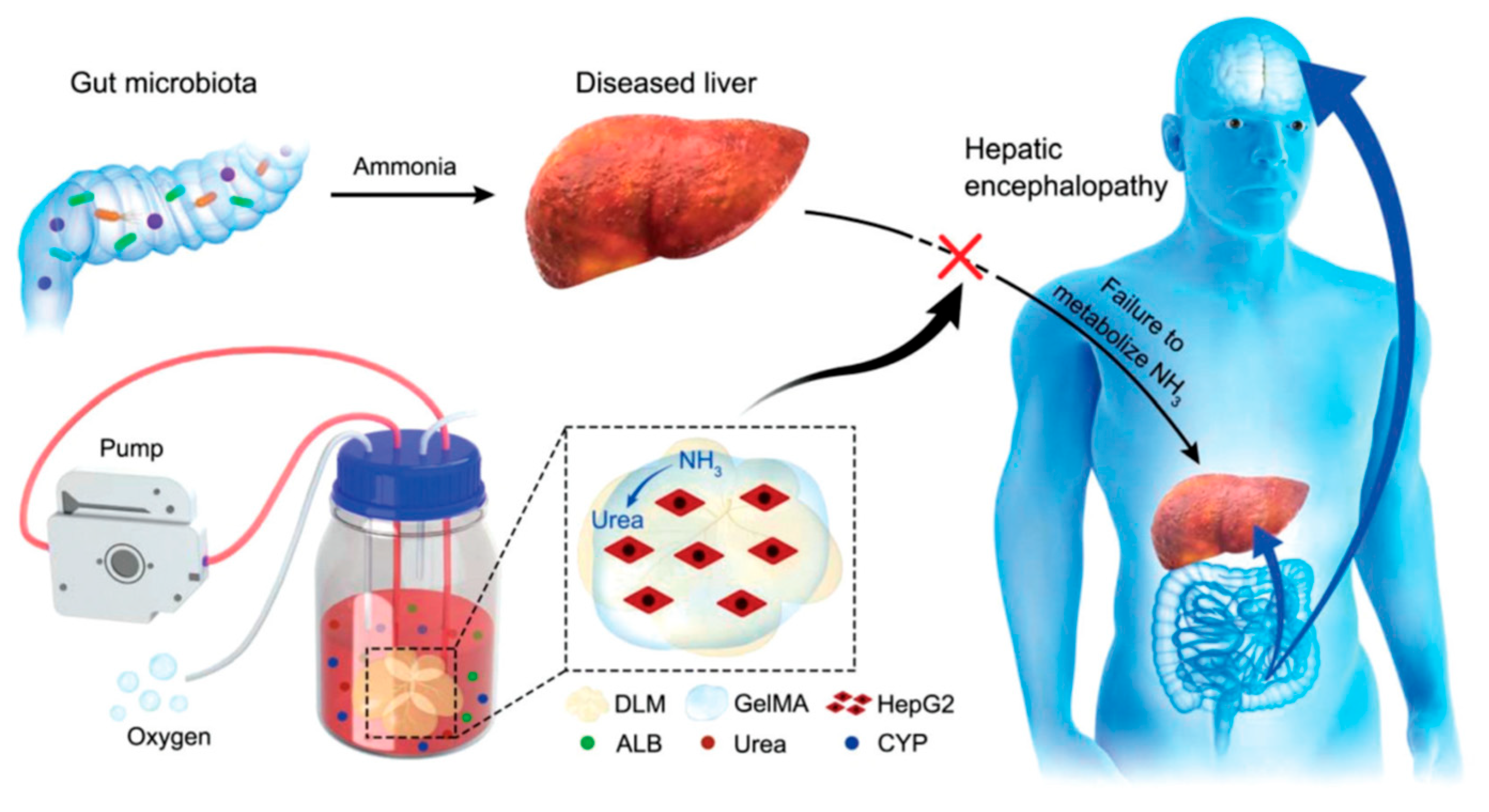 Artificial Liver Artificial Liver