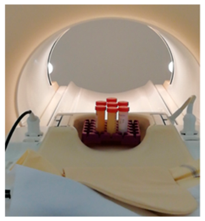 Liver Iron Content and Magnetic Resonance: A “Biopsy-Free ...