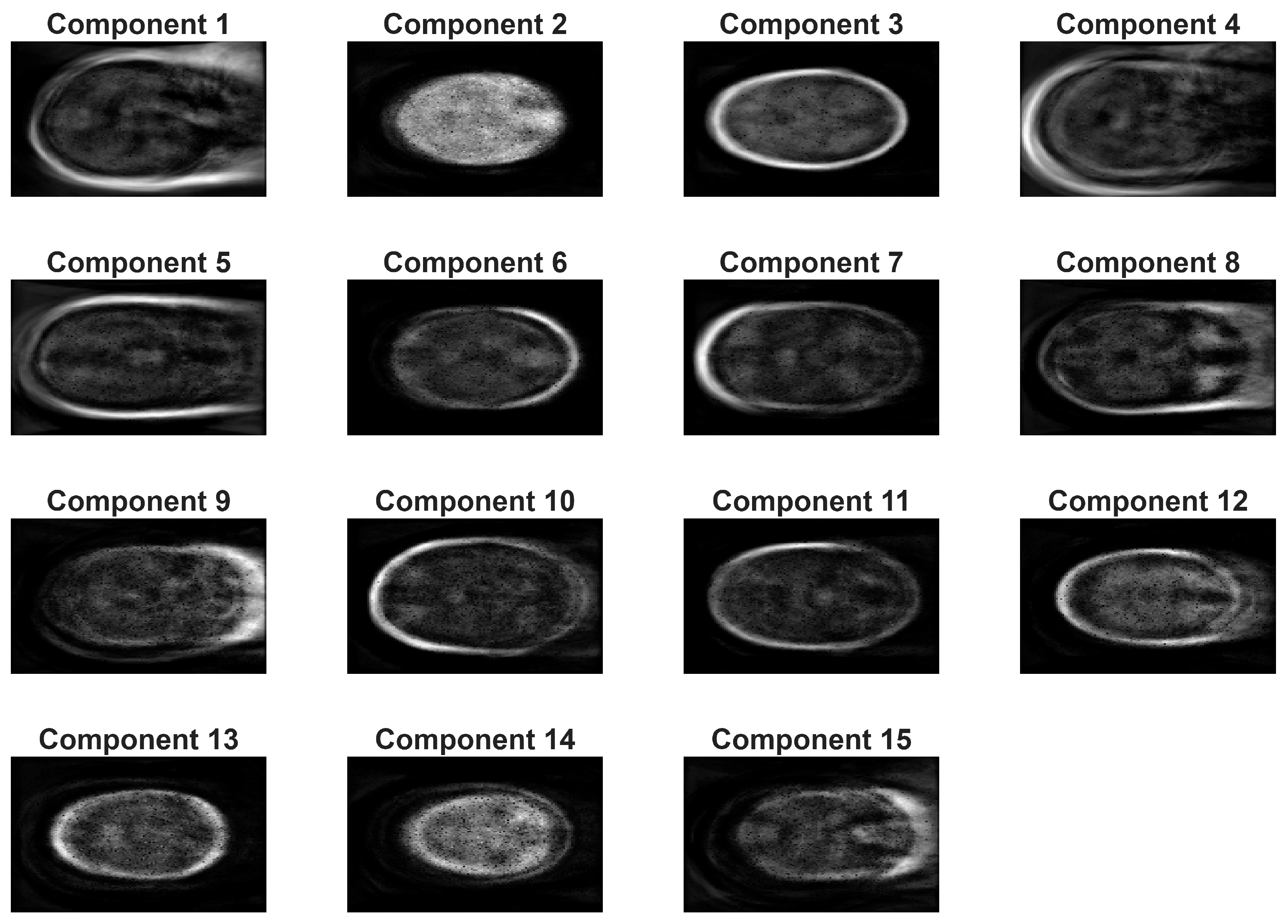 Diffusion-Based Feature Denoising and Using NNMF for Robust Brain Tumor ...