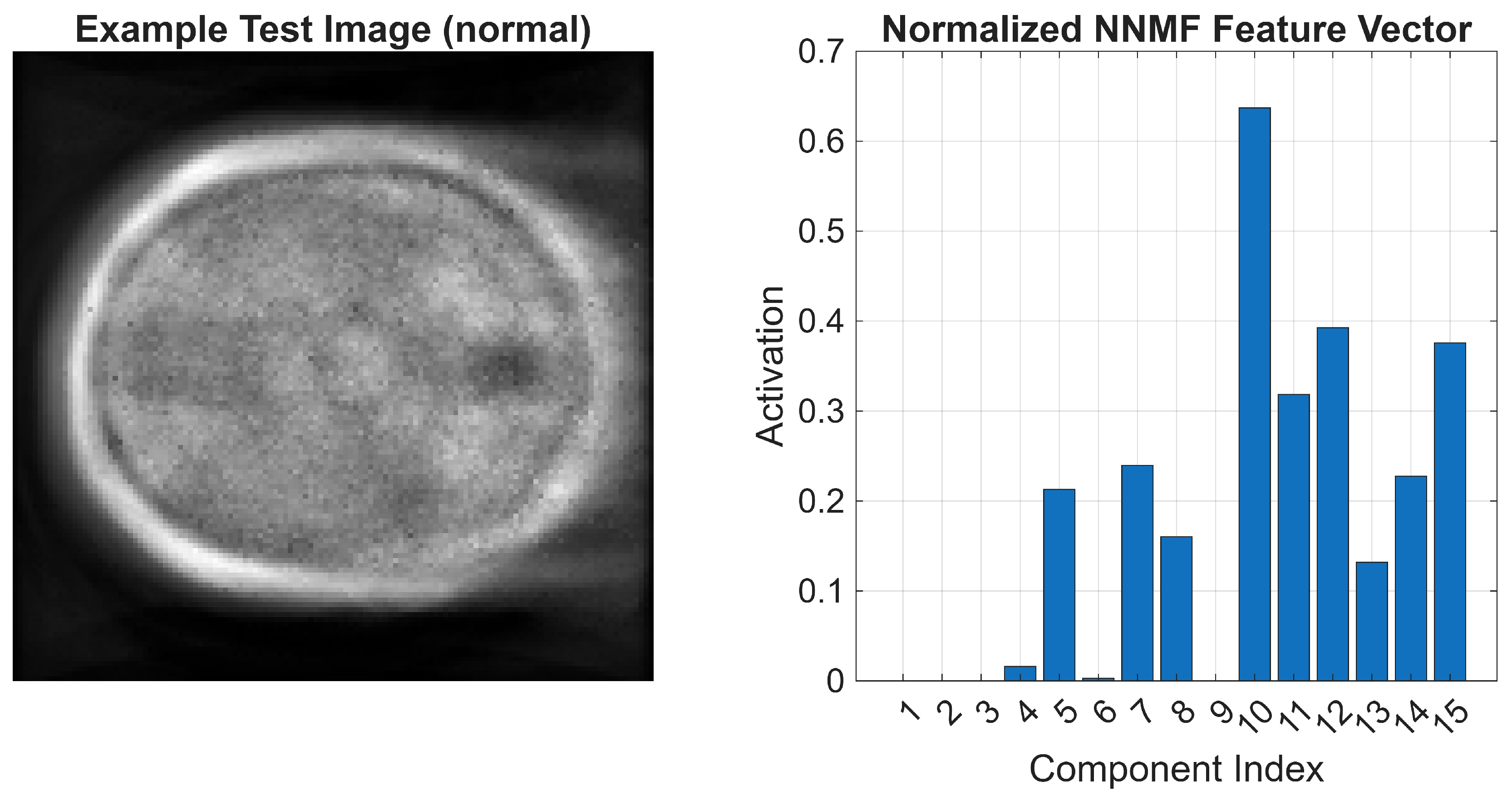Diffusion-Based Feature Denoising and Using NNMF for Robust Brain Tumor ...