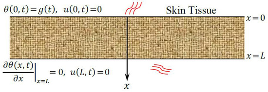 Refined Lord–Shulman Theory for 1D Response of Skin Tissue under Ramp ...