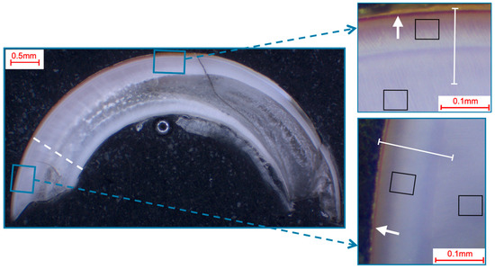 Elemental Compositions of Enamel or Dentin in Human and Bovine Teeth ...