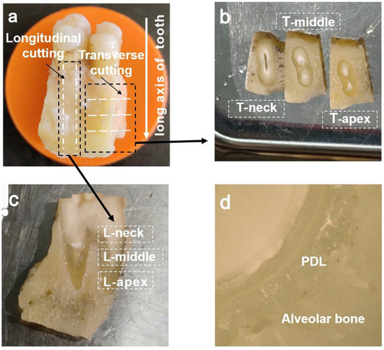 Construction of Human Periodontal Ligament Constitutive Model Based on ...