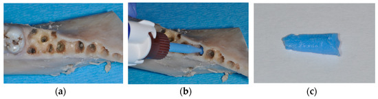 In Vitro Handling Characteristics of a Particulate Bone Substitute for ...