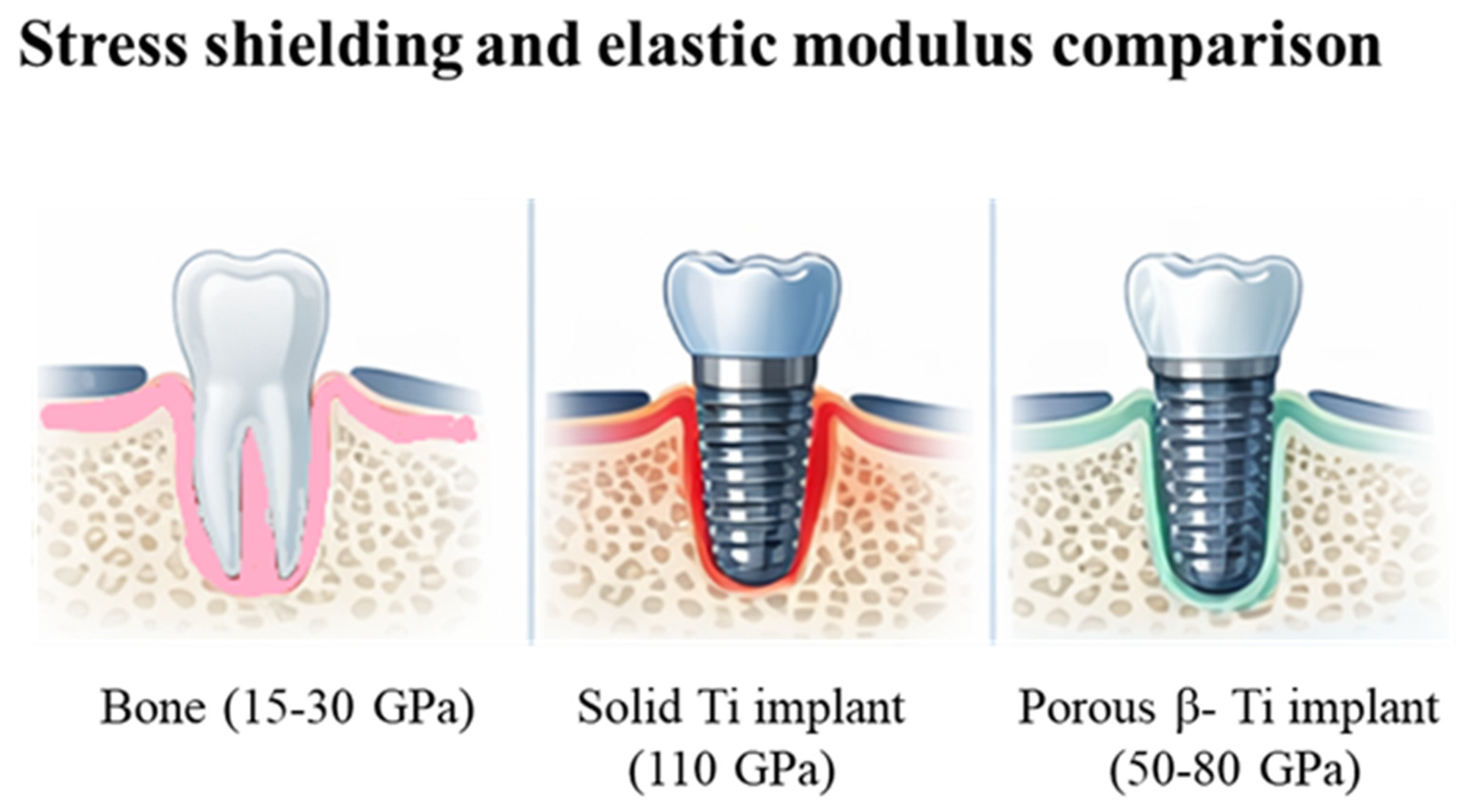 Advancements in Individual Dental Implants: A State-of-the-Art Review ...