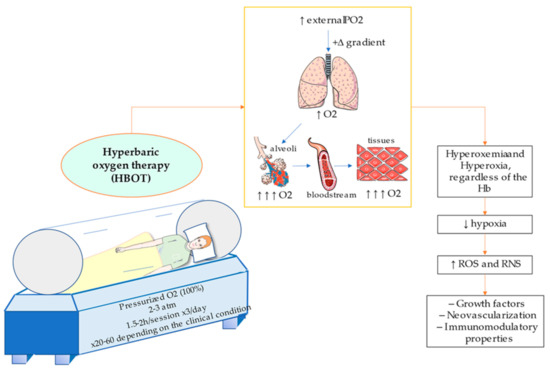Medicina Free Full Text A General Overview On The Hyperbaric Oxygen Medicina Free Full Text A General Overview On The Hyperbaric Oxygen