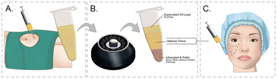 Safety of Aesthetic Medicine Procedures in Patients with Autoimmune ...