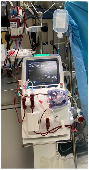 A New Apheresis Device for Antithrombotic Drug Removal during Off-Pump ...