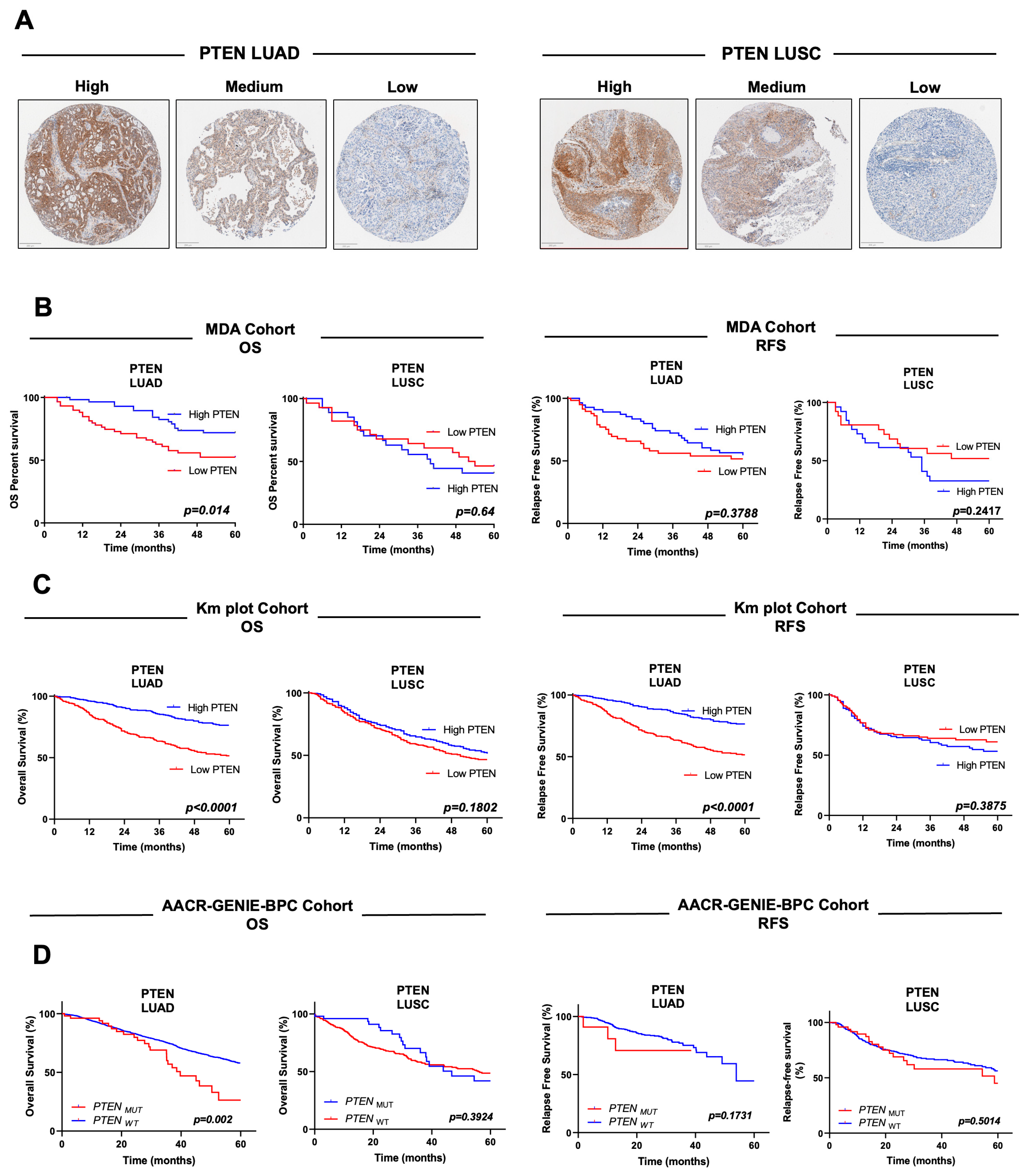 Loss of PTEN as an Independent Poor Prognosis Indicator in Lung ...