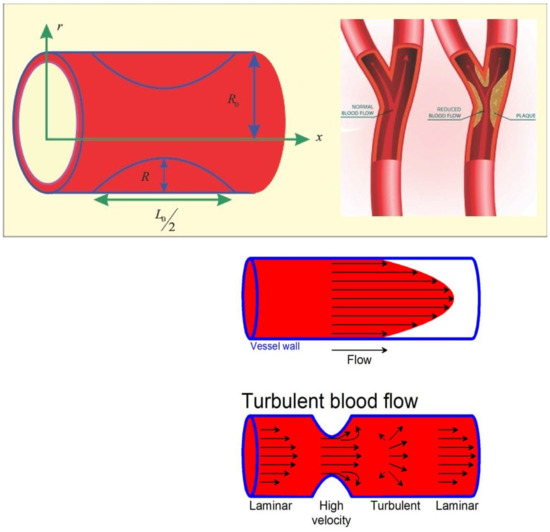Micromachines | Free Full-Text | Blood Flow of Au-Nanofluid Using Sisko ...