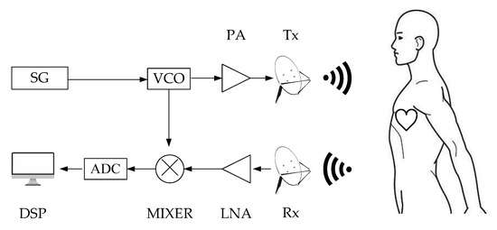 Real-Time Heart Rate Detection Method Based on 77 GHz FMCW Radar
