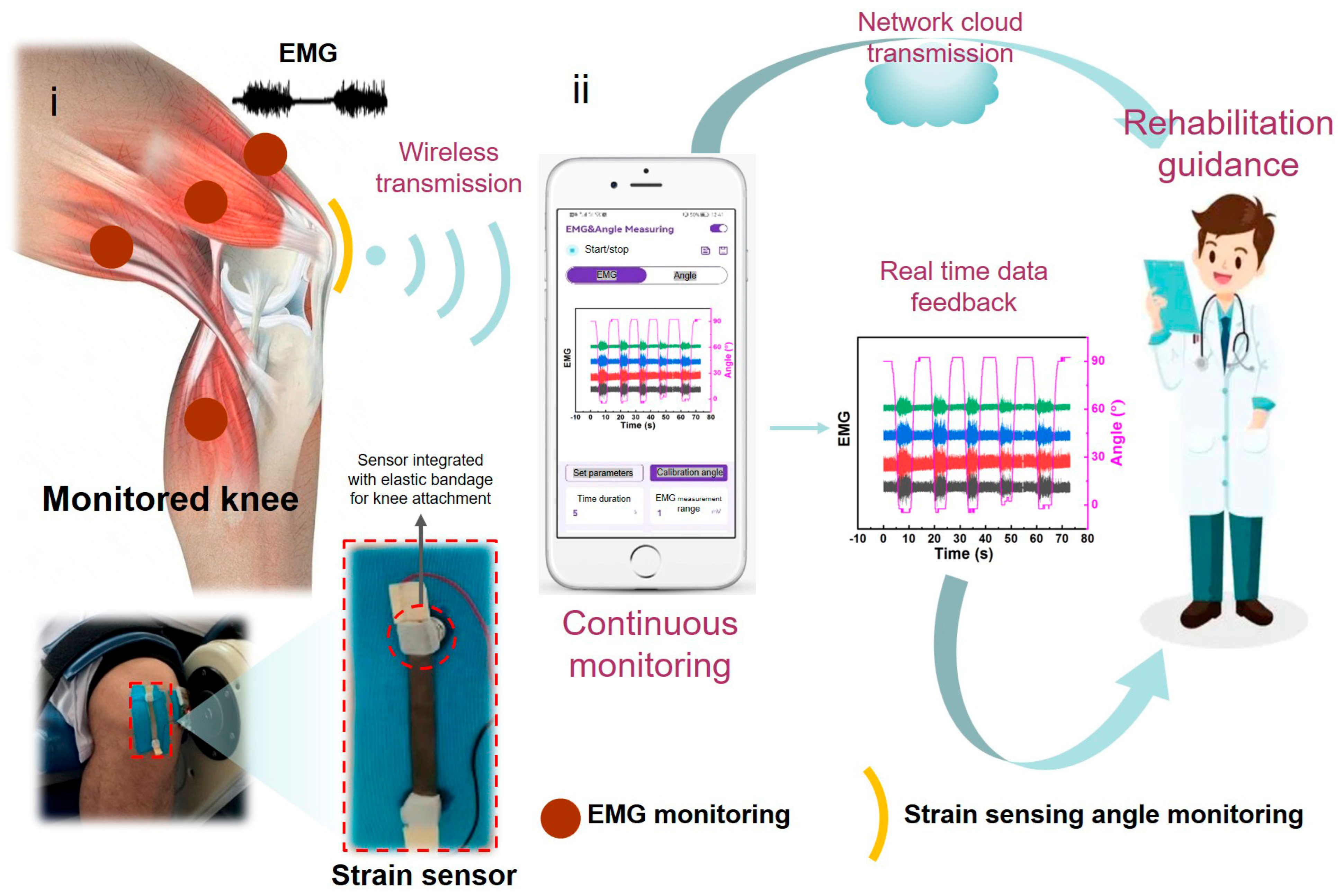 Strain and Electromyography Dual-Mode Stretchable Sensor for Real-Time ...