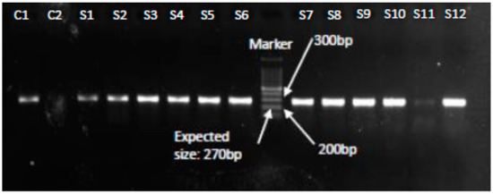 First mecC and mecA Positive Livestock-Associated Methicillin Resistant ...