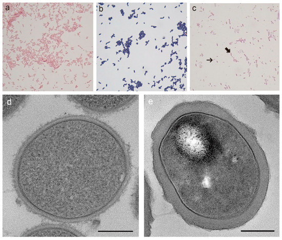 Is Lactobacillus Gram-Positive? A Case Study of Lactobacillus iners