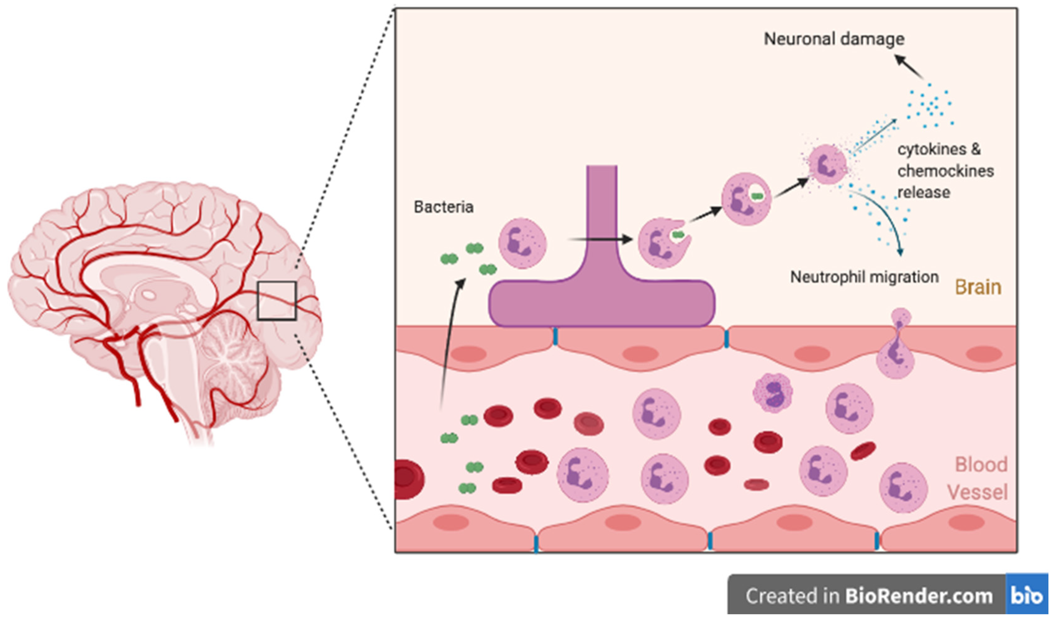 Microorganisms Free Full Text Bacterial Meningitis In Children Microorganisms Free Full Text Bacterial Meningitis In Children