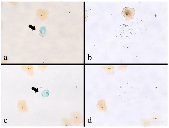 Optimal Papanicolaou Smear Conditions for Manual Microdissection of ...
