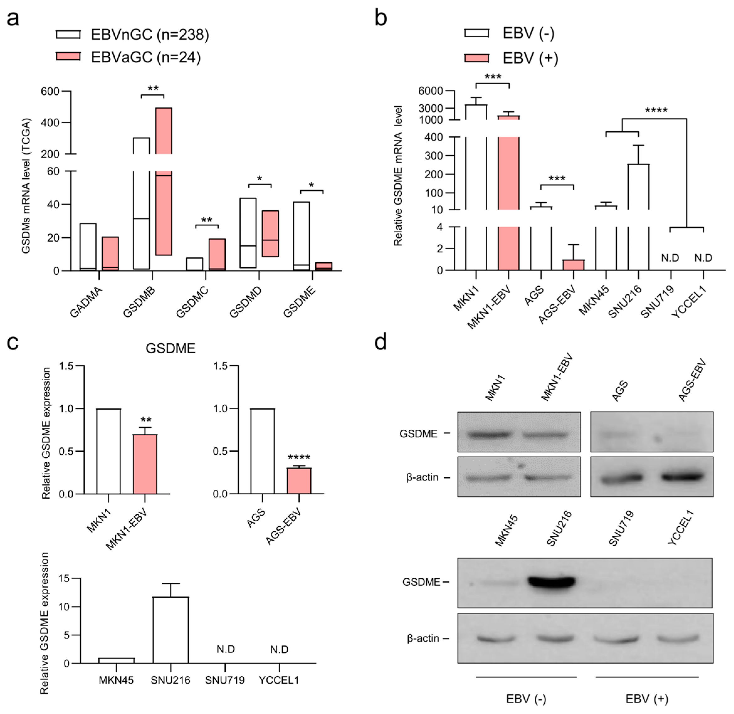 Epstein–Barr Virus Silences GSDME and Pyroptosis in Gastric Cancer