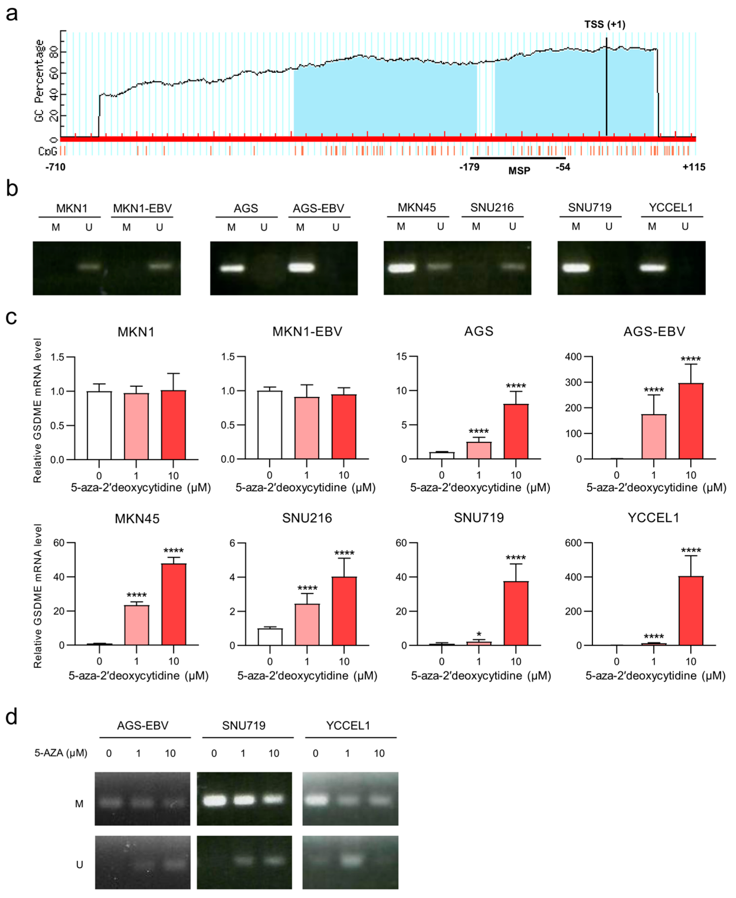 Epstein–Barr Virus Silences GSDME and Pyroptosis in Gastric Cancer