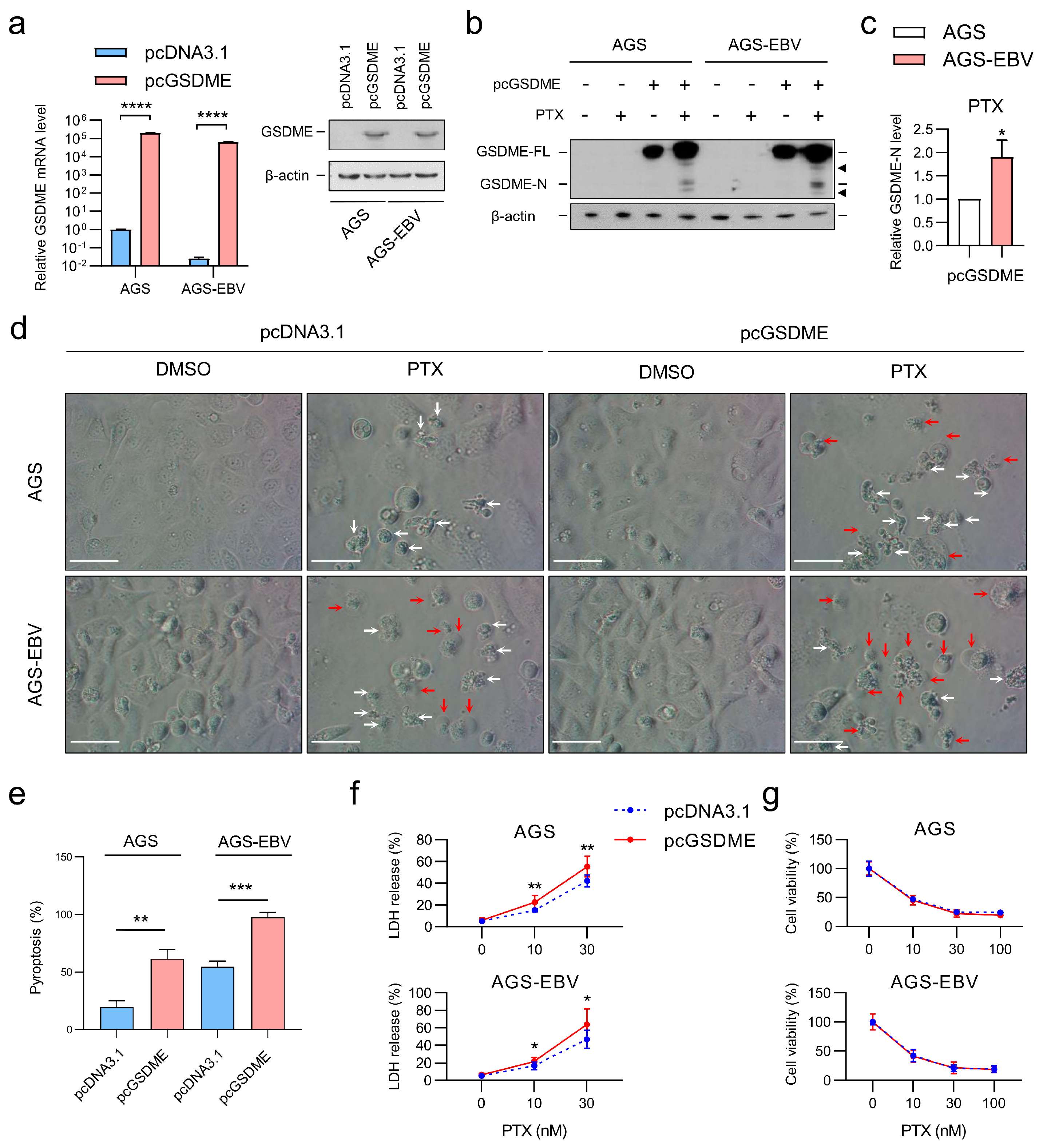 Epstein–Barr Virus Silences GSDME and Pyroptosis in Gastric Cancer