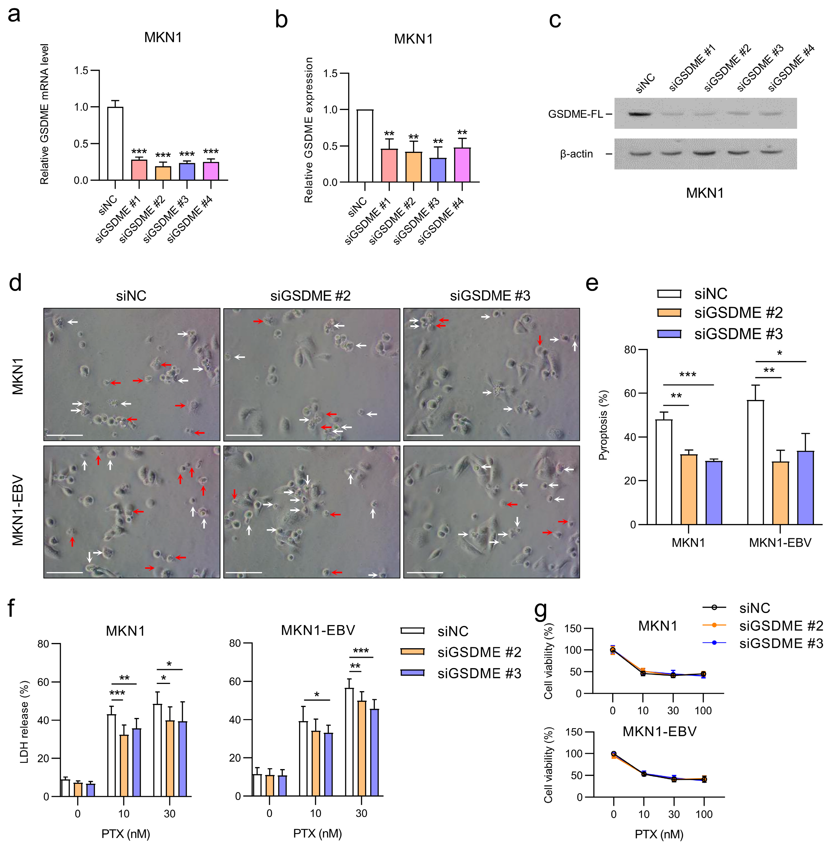 Epstein–Barr Virus Silences GSDME and Pyroptosis in Gastric Cancer