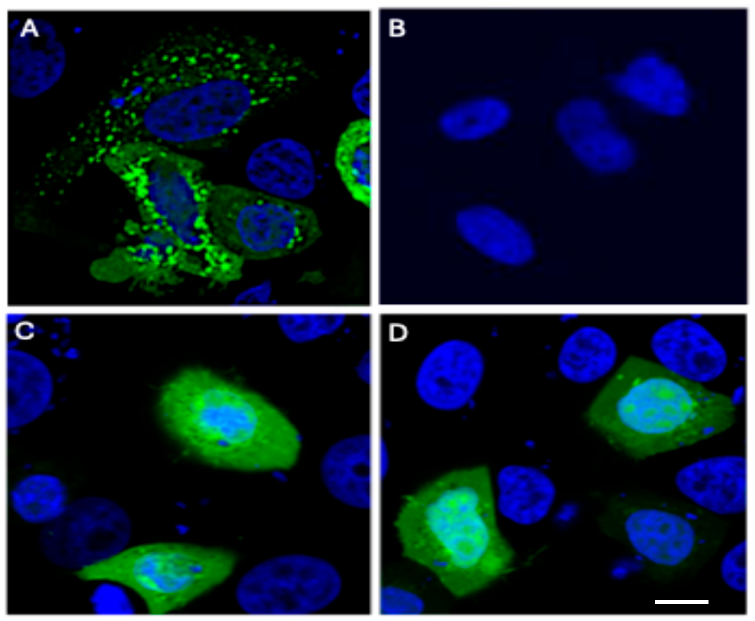 Selective Budding of SARS-CoV-Like Particles from Glycolipid-Enriched ...