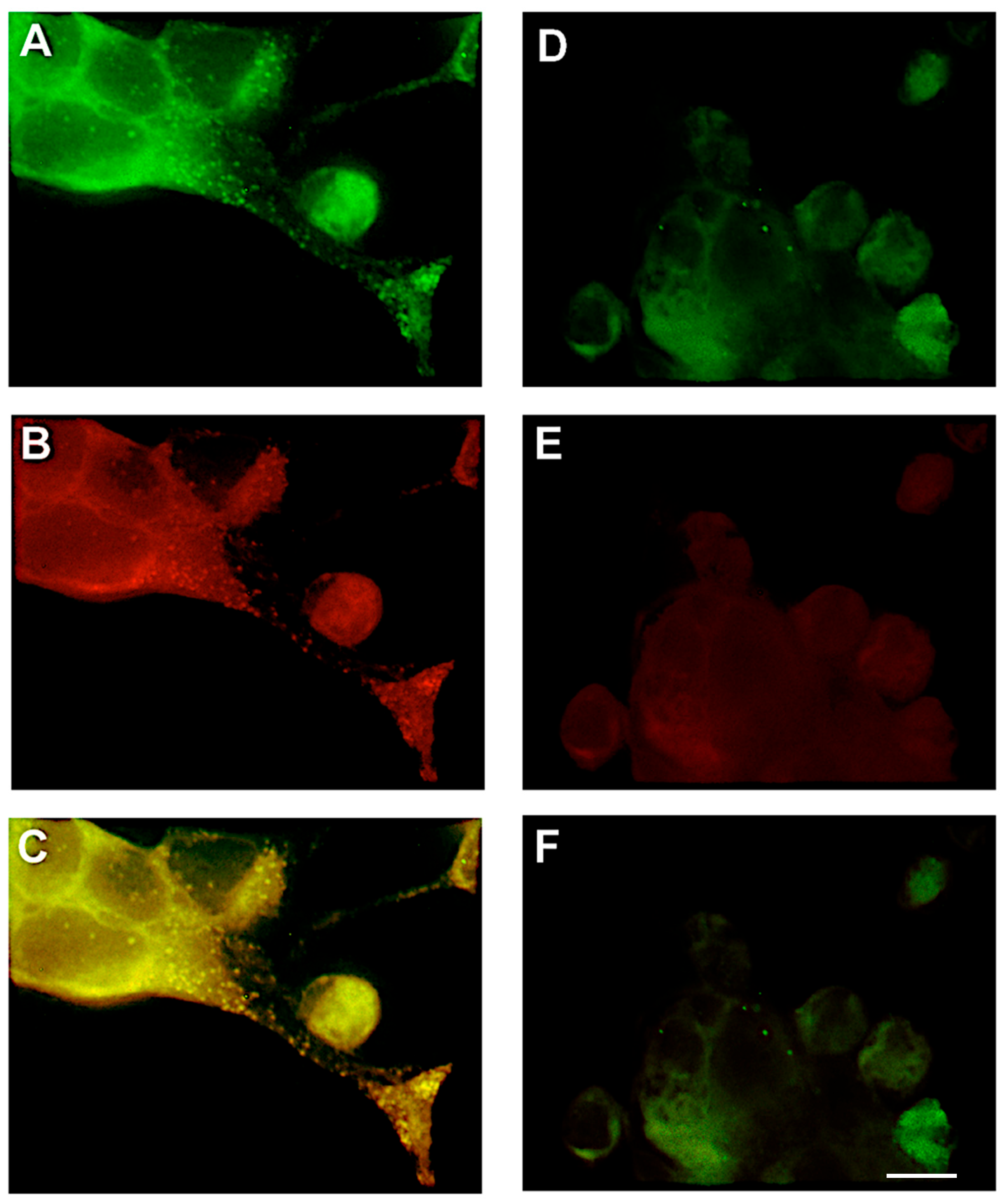 Selective Budding of SARS-CoV-Like Particles from Glycolipid-Enriched ...