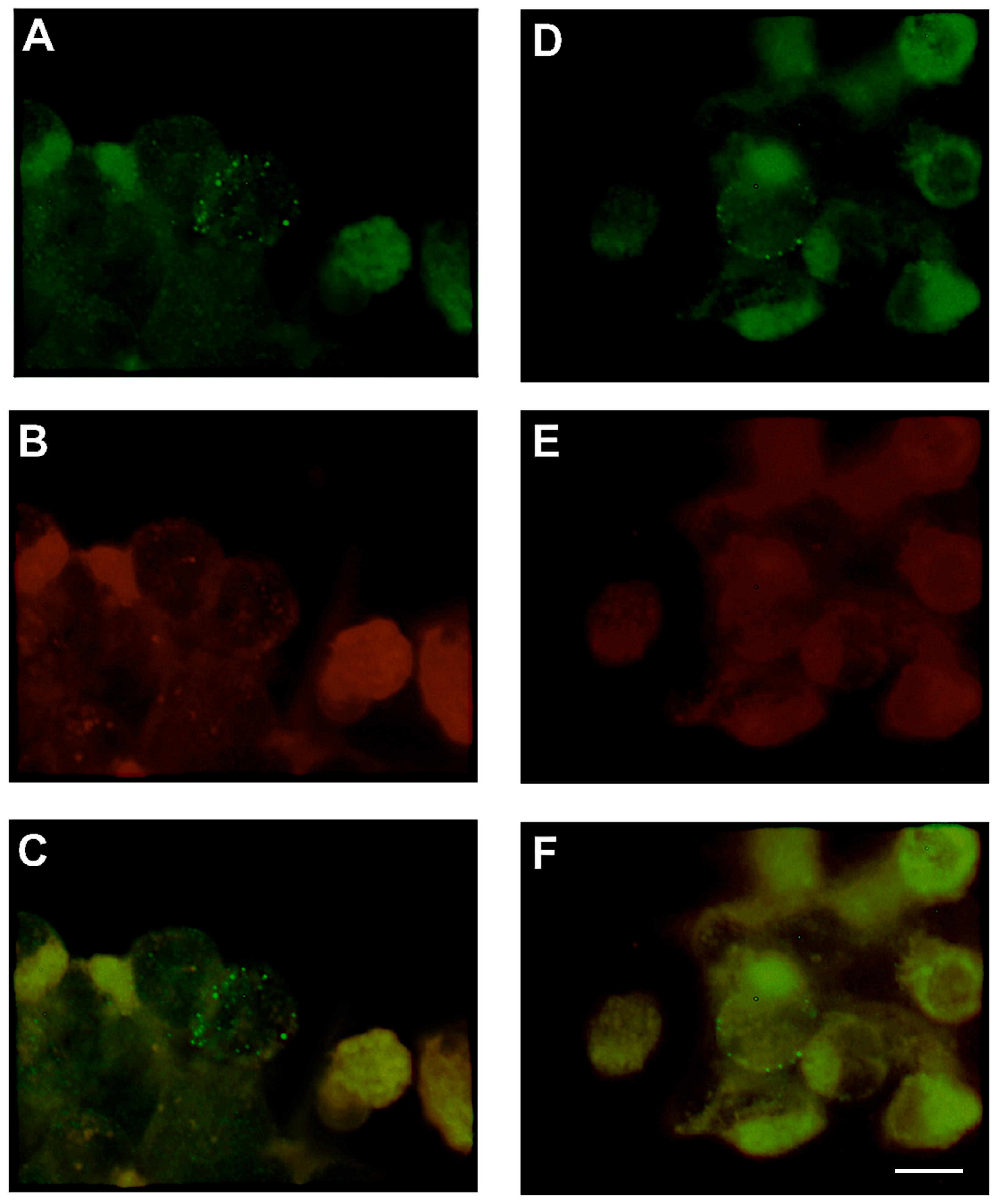 Selective Budding of SARS-CoV-Like Particles from Glycolipid-Enriched ...
