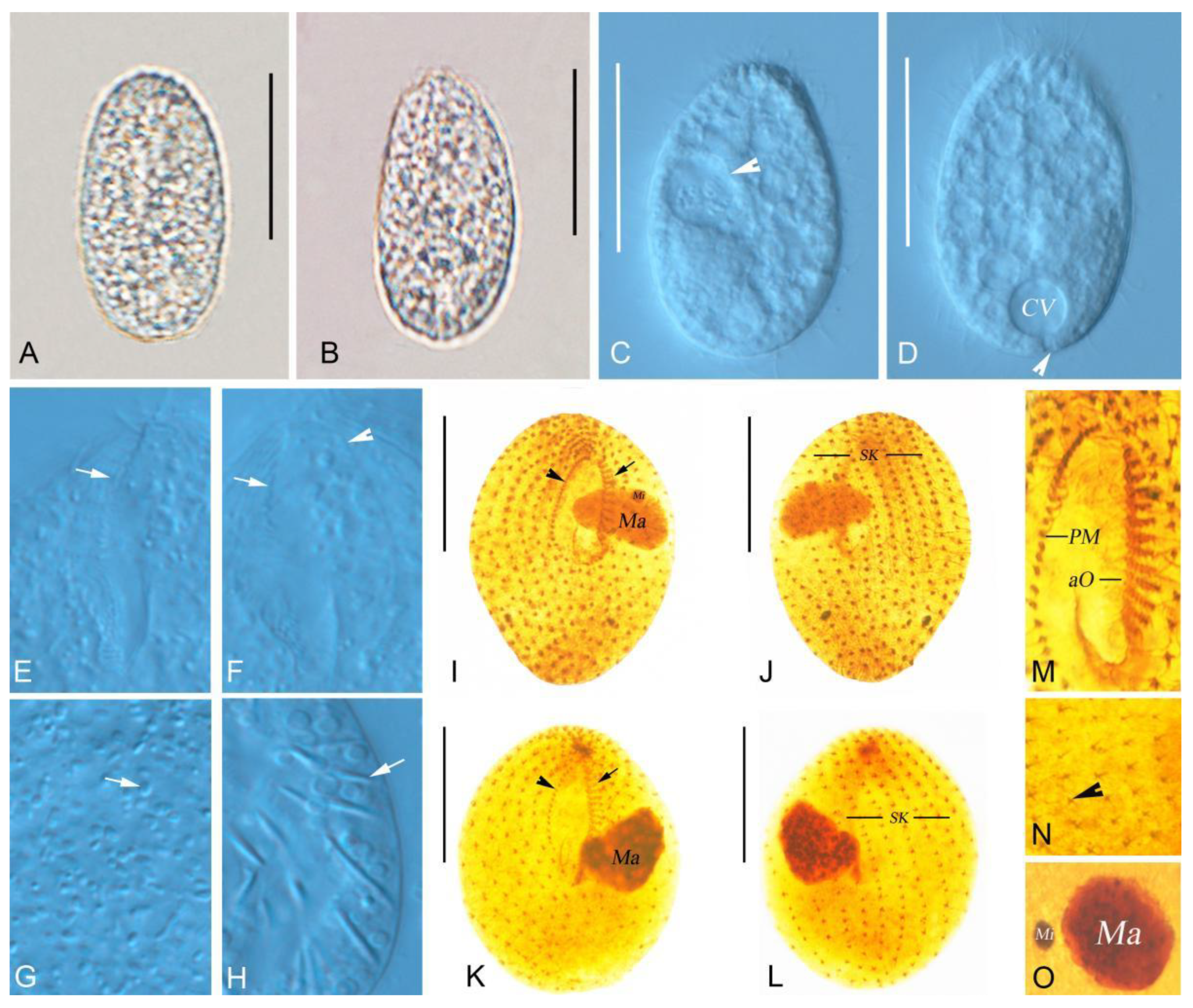 Morphology and Molecular Phylogeny of Two Soil Ciliate Species ...