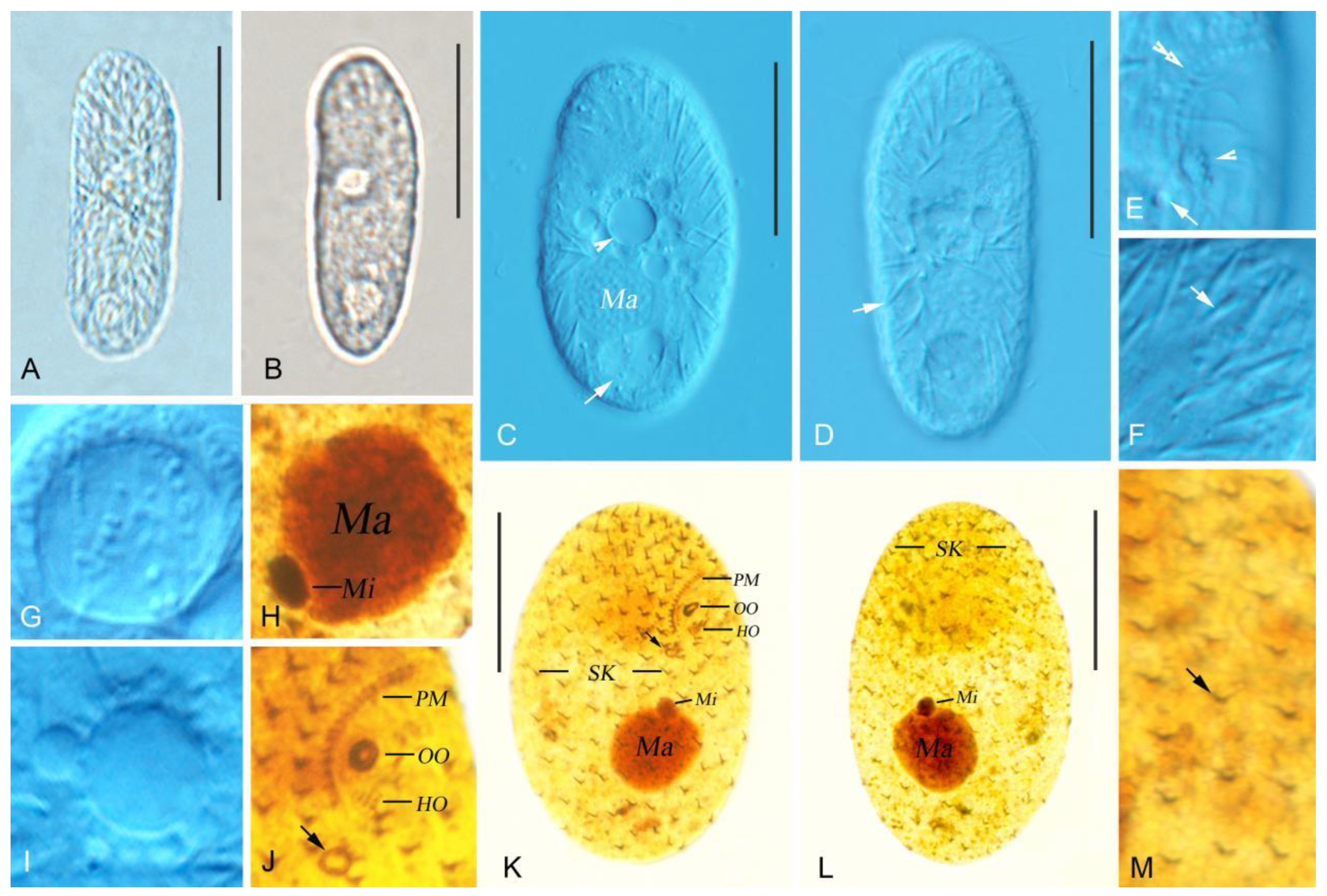 Morphology and Molecular Phylogeny of Two Soil Ciliate Species ...