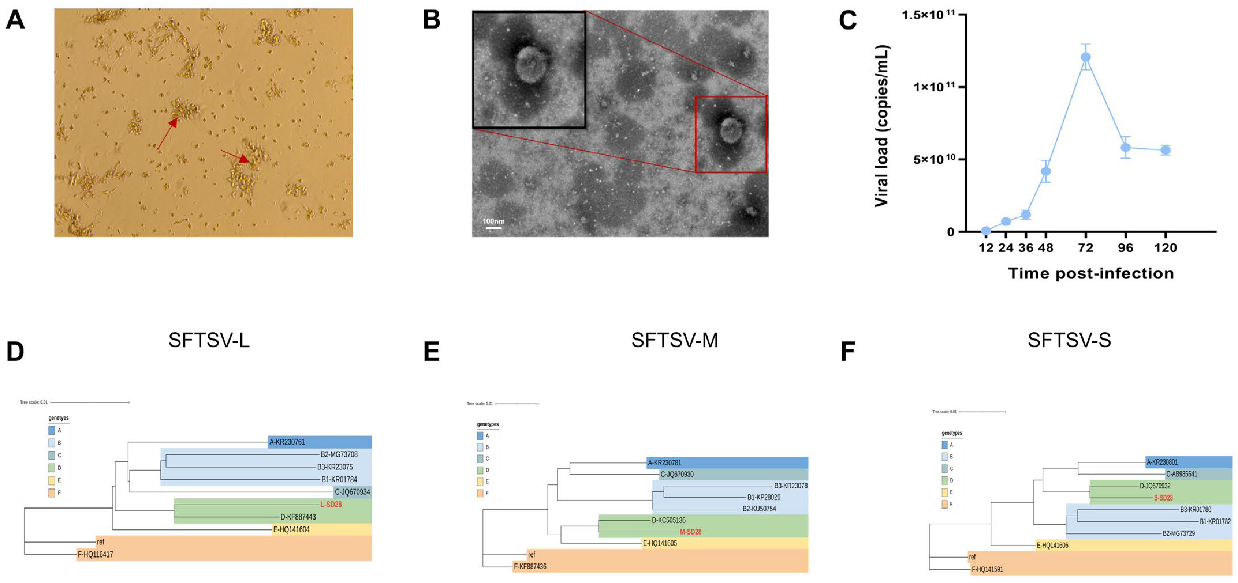 Transcriptomic and RNA Modification Landscape of Severe Fever with ...