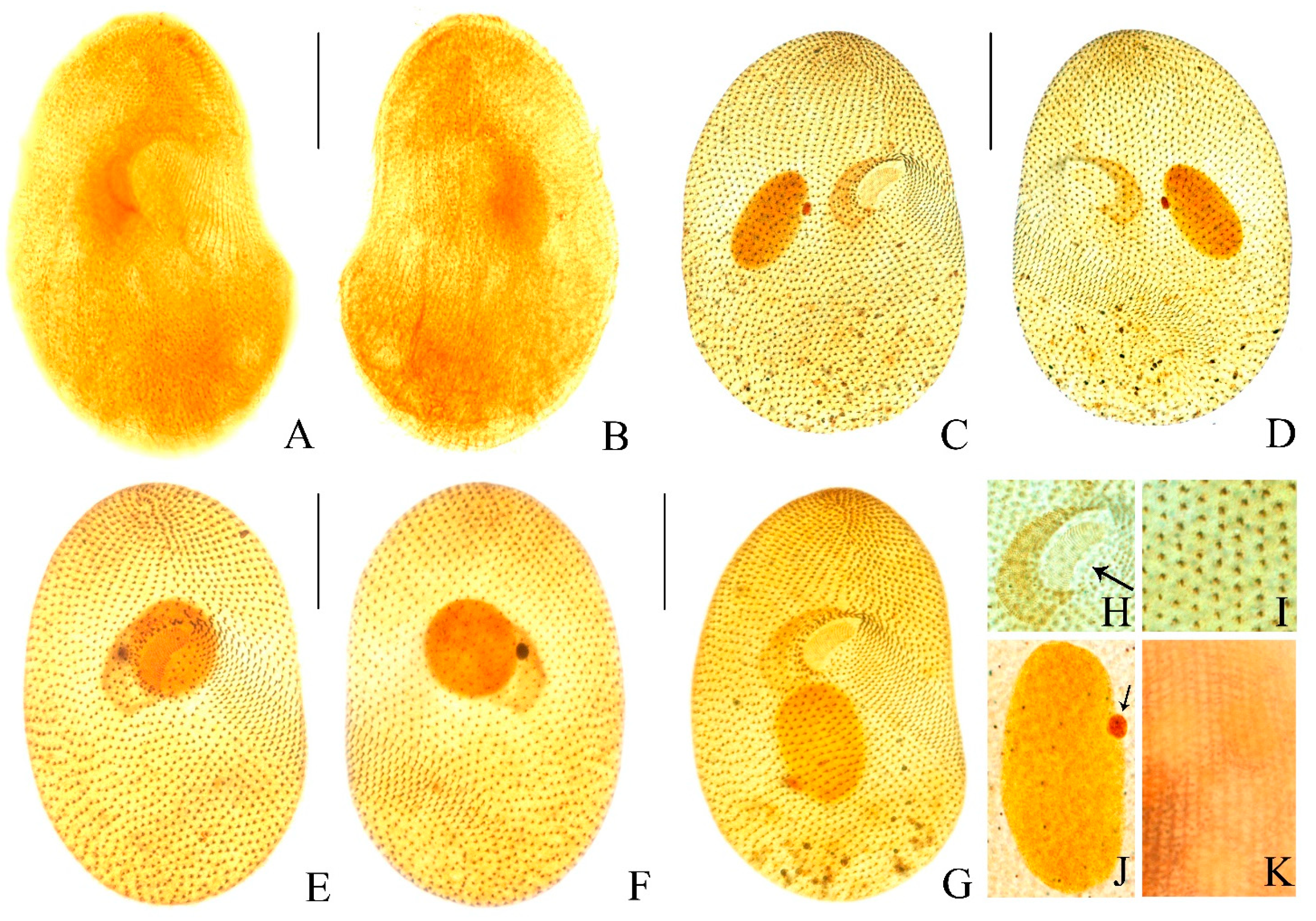 Morphological and Molecular Phylogeny of Two New Ciliate Species ...