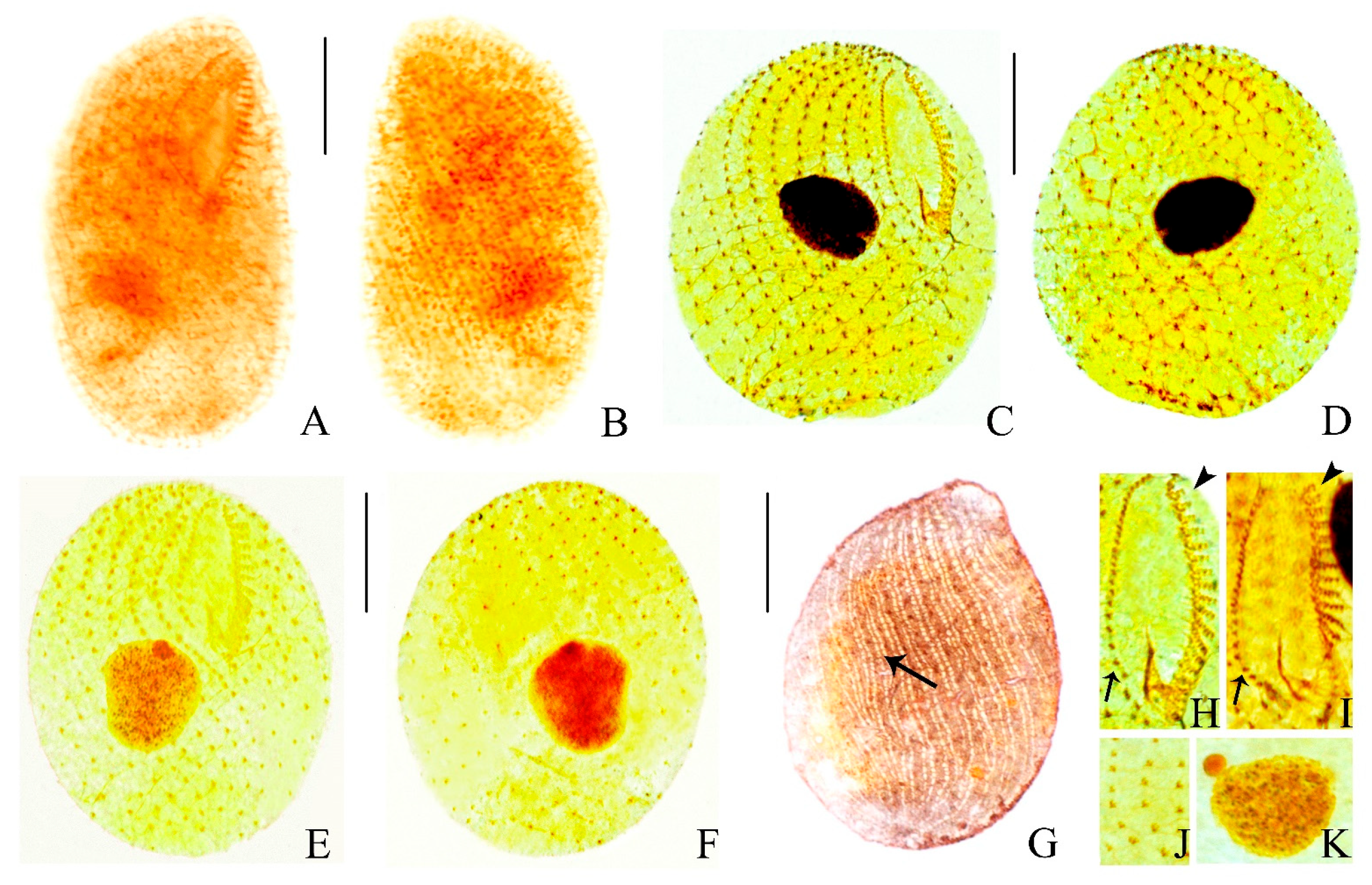 Morphological and Molecular Phylogeny of Two New Ciliate Species ...