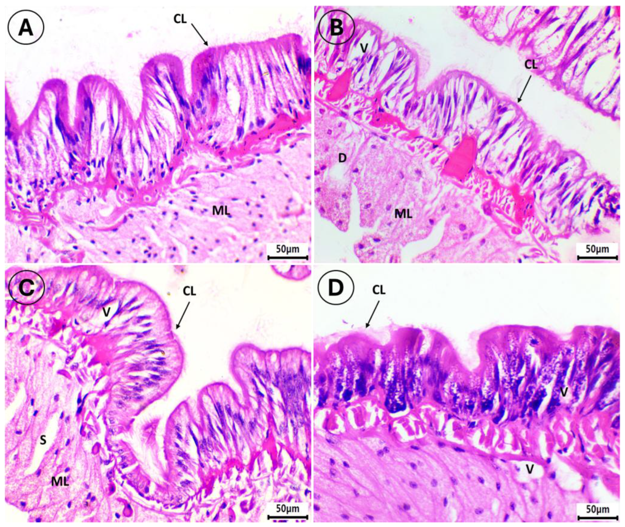Can Cigarette Butt-Derived Cellulose Acetate Nanoplastics Induce ...