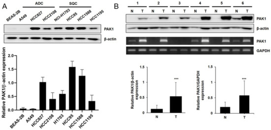 PAK1 as a Potential Therapeutic Target in Male Smokers with EGFR-Mutant ...