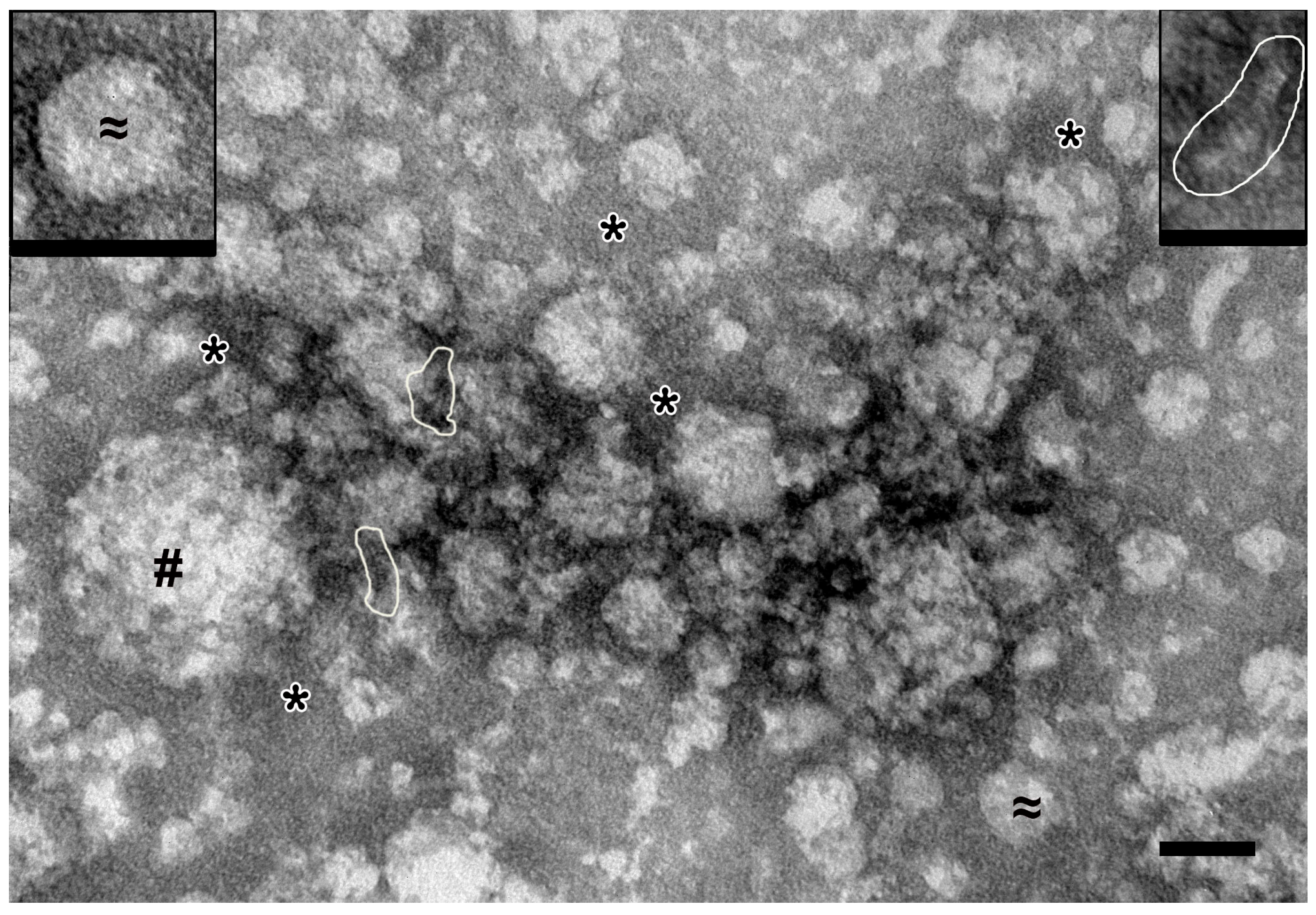 Very Stable High-Molecular-Mass Multiprotein Complexes in Different ...