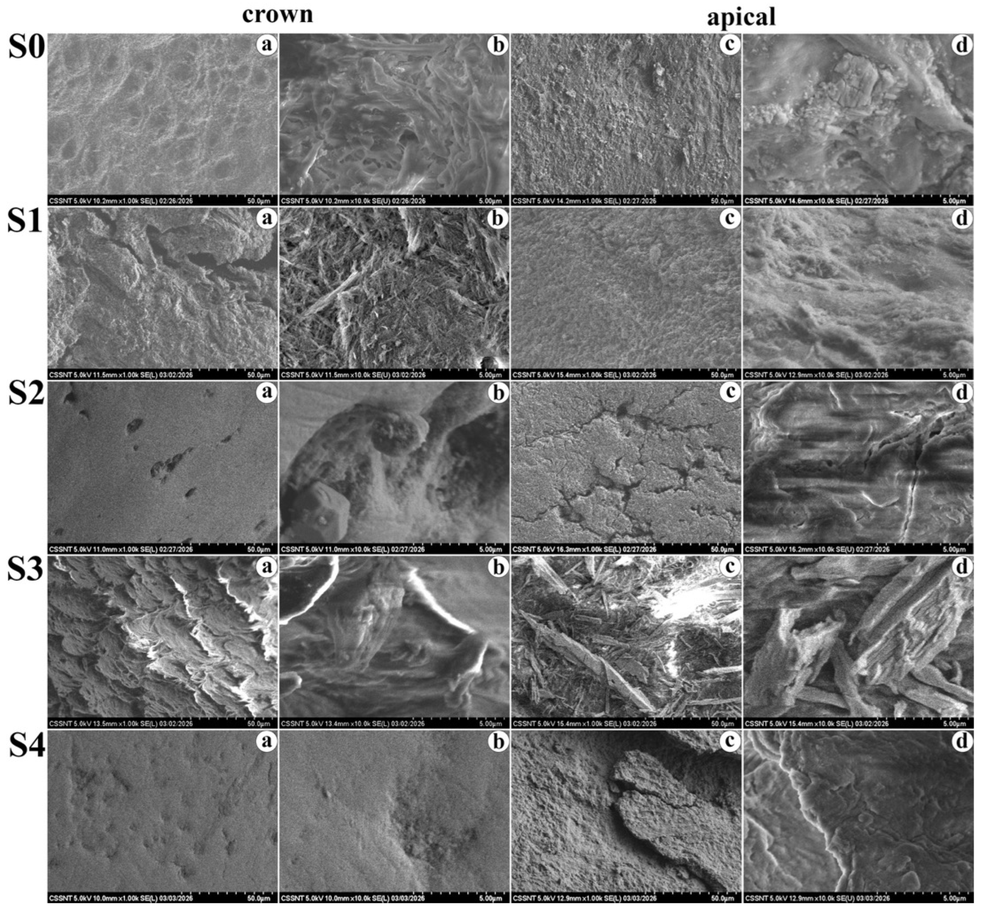Tracing Corrosive Damage in Human Teeth: A Forensic Pilot Study of ...