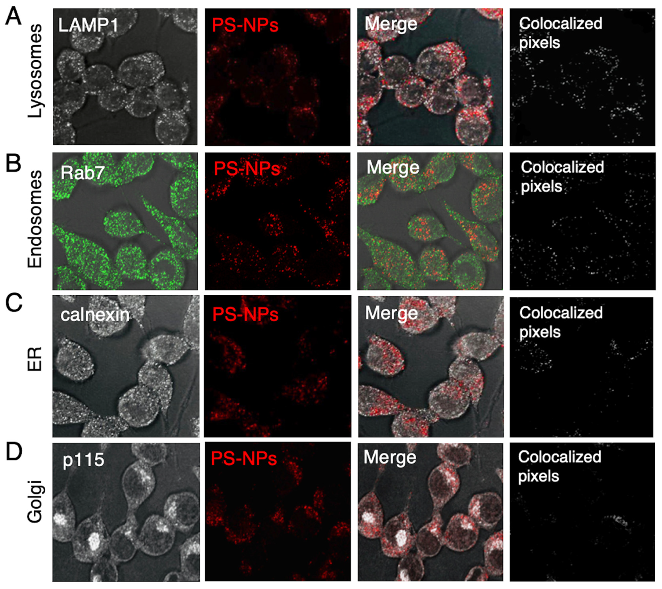 Polystyrene Nanoplastics Increase Macrophage Bactericidal Activity ...
