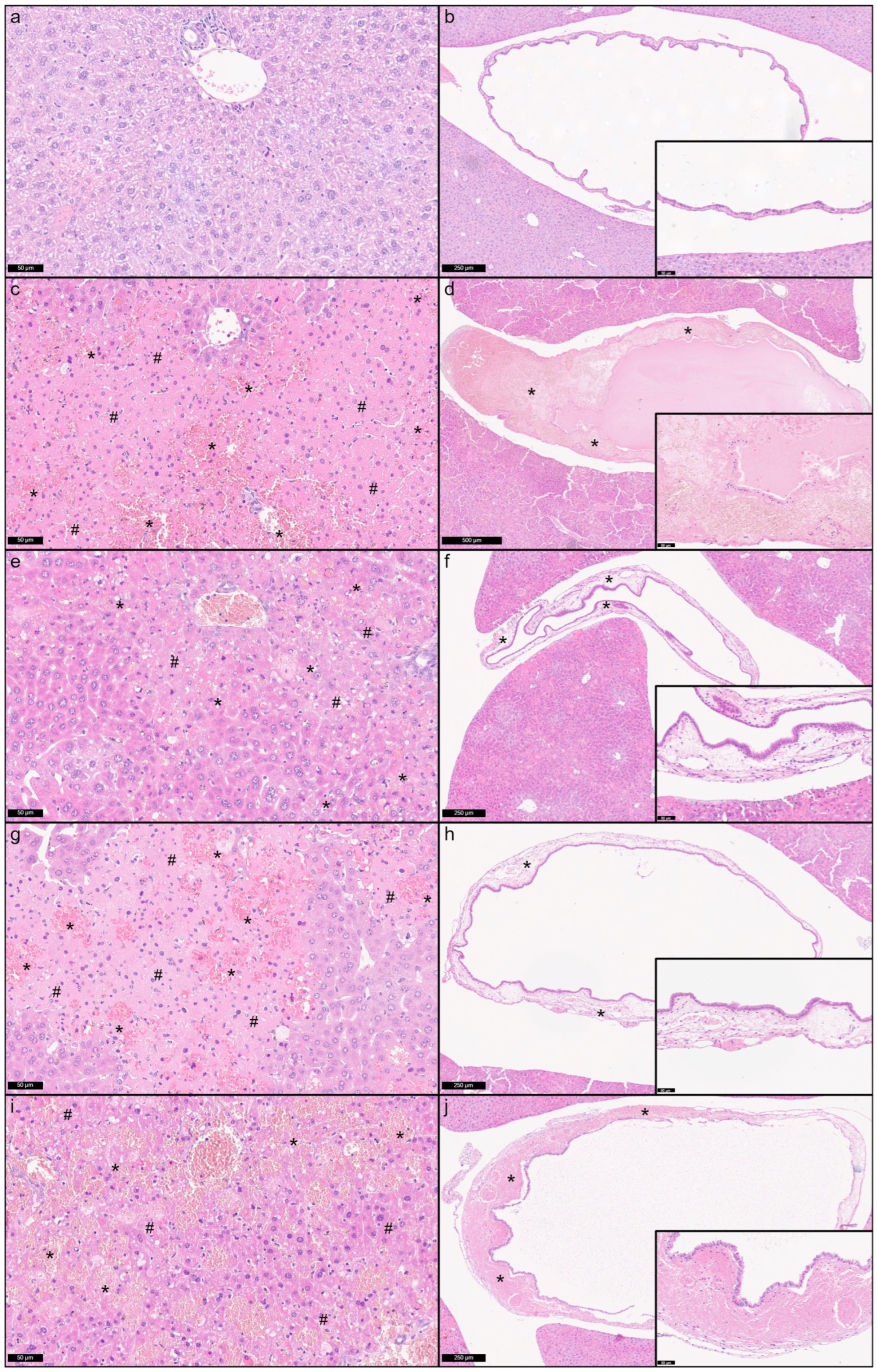 Batch-Dependent Hepatobiliary Toxicity of 10 nm Silver Nanoparticles ...