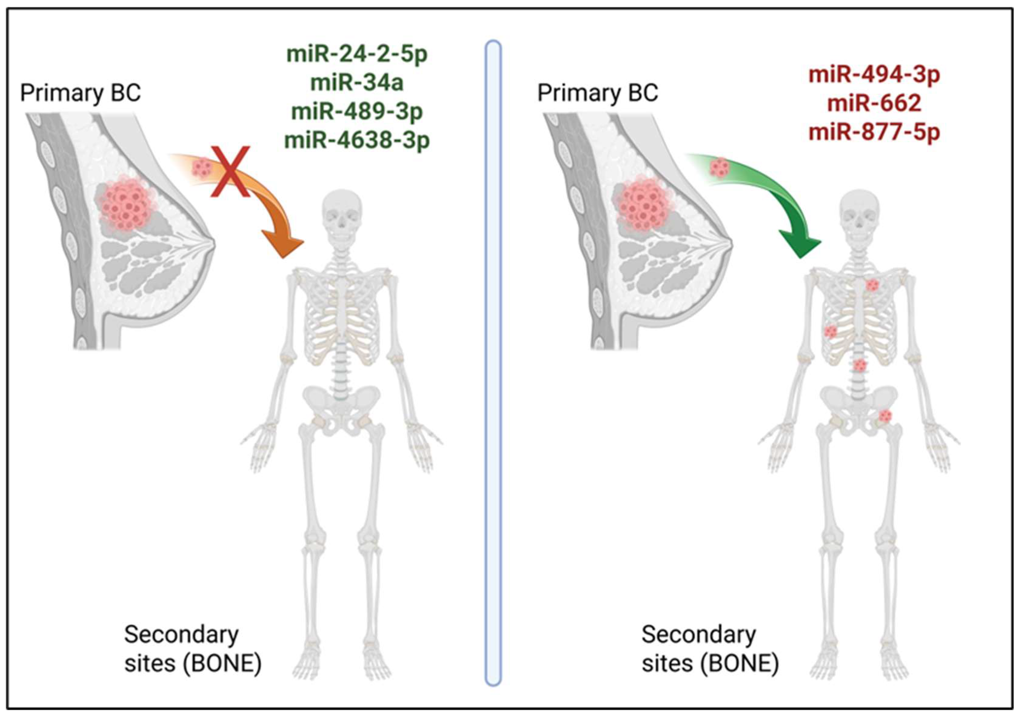 MicroRNAs in Breast Cancer Bone Metastasis Formation and Progression ...
