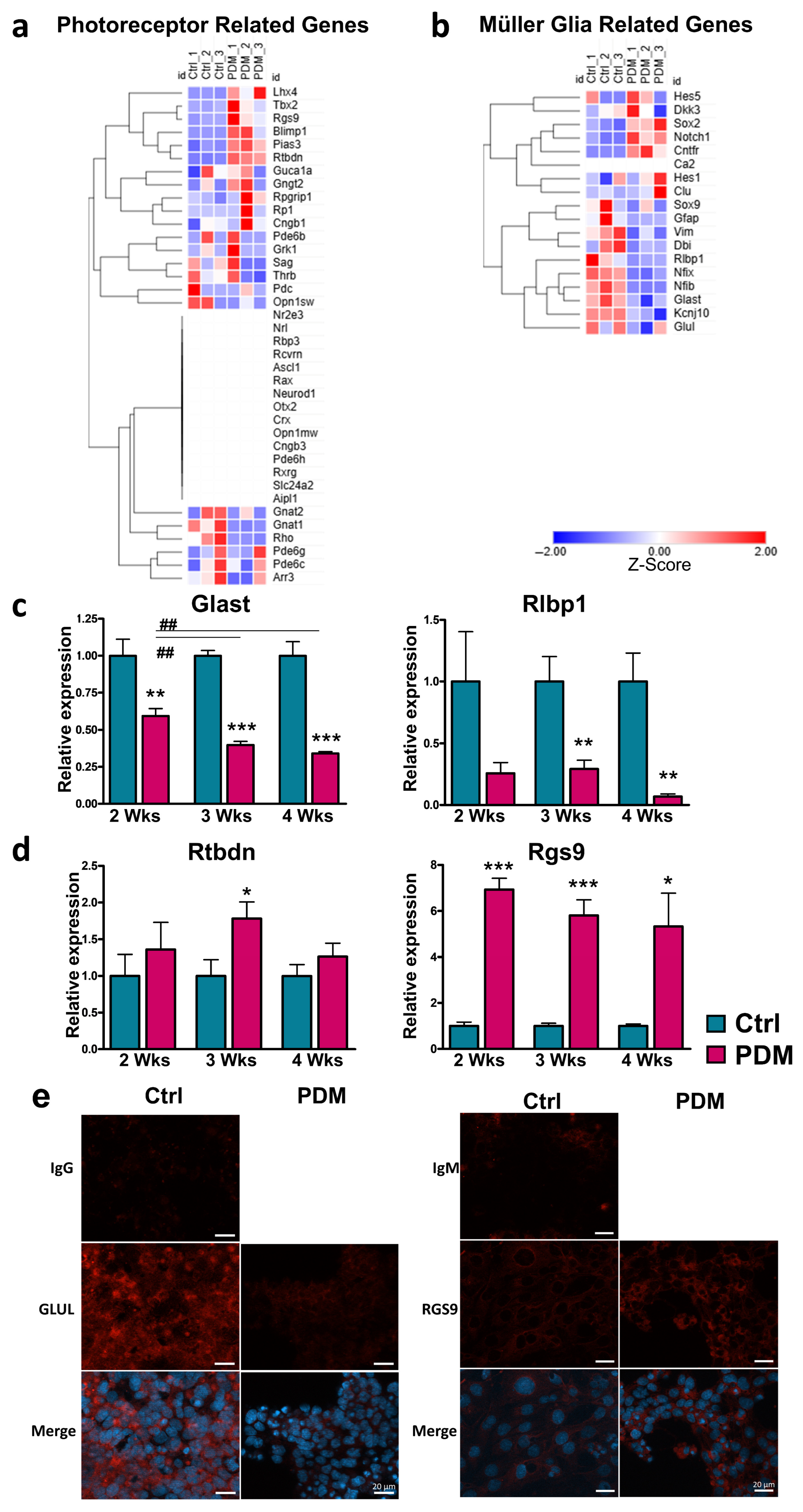 RNA-Seq Analysis of Neuronal Gene Expression Changes in Rat Müller Glia ...