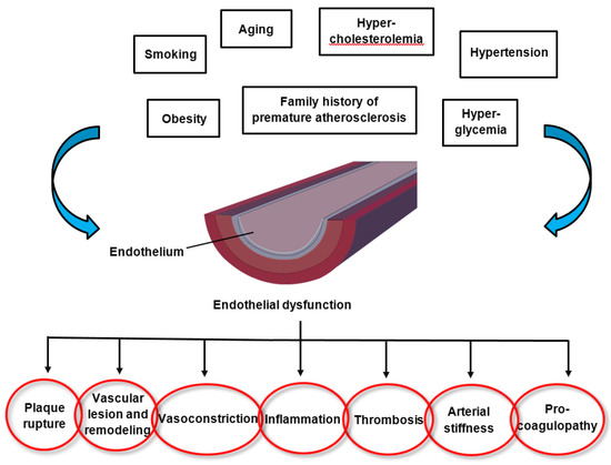 Oxidative Stress in Cardiovascular Diseases: Still a Therapeutic Target?