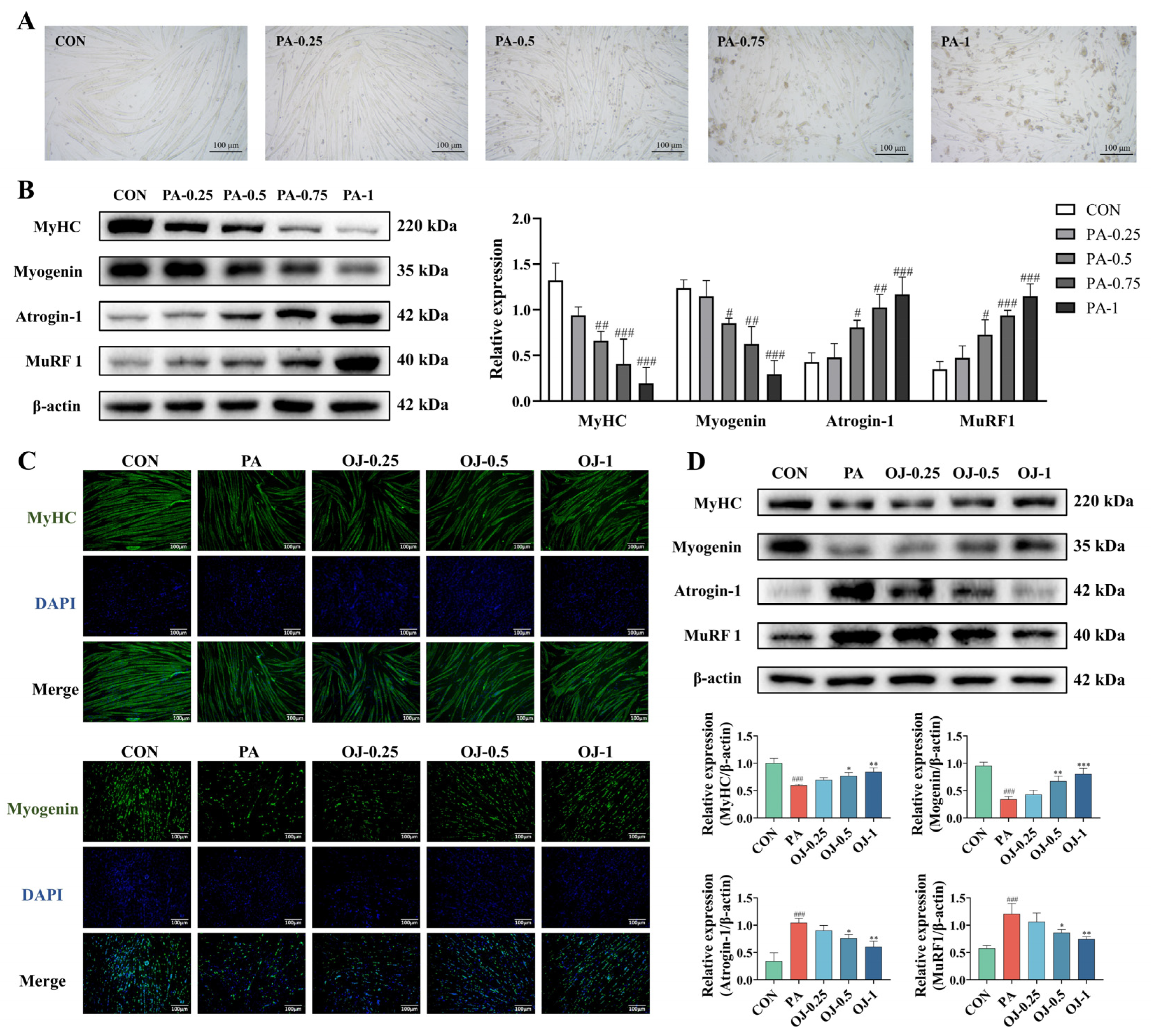 Ophiopogon japonicus Root Extract Attenuates Obesity-Induced Muscle ...