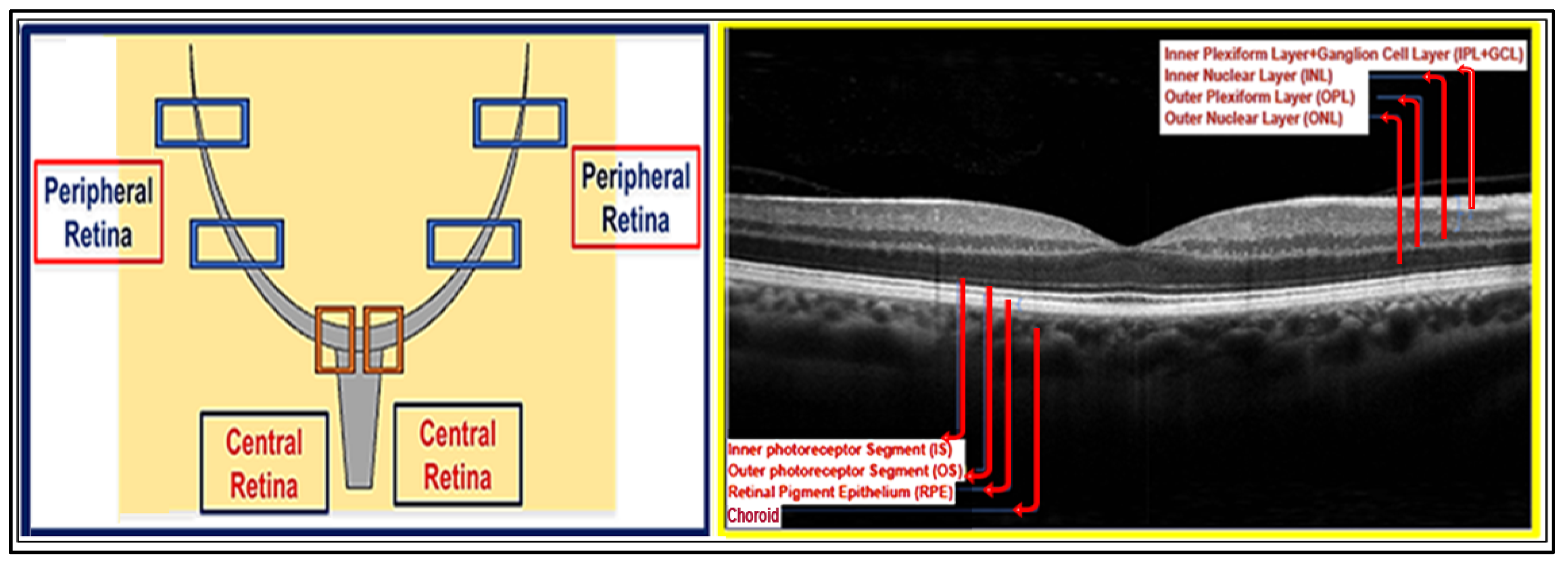 Modulating One-Carbon Metabolism with B-Vitamins to Protect the Retinal ...