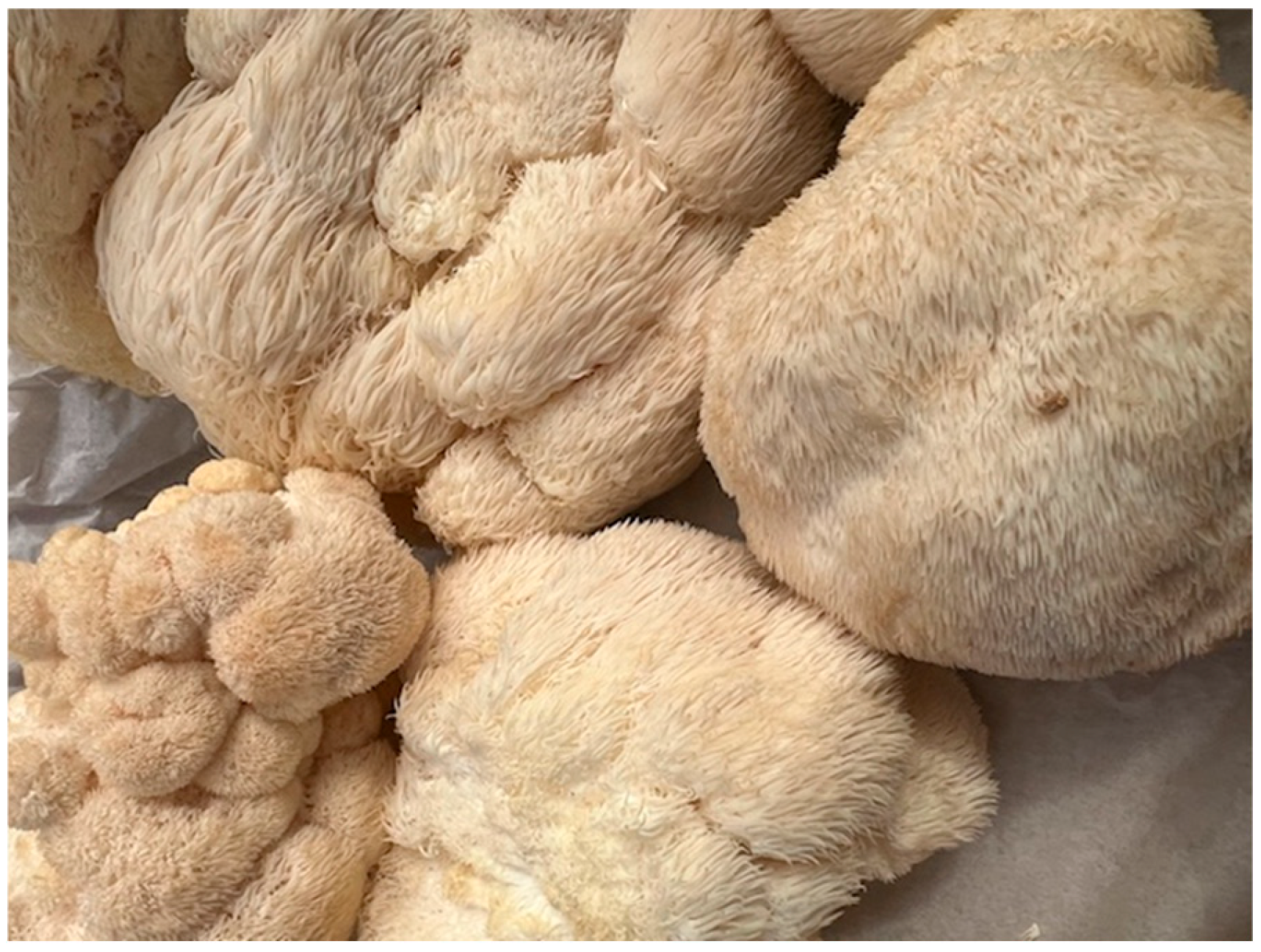 Characterization of Children with Intellectual Disabilities and ...