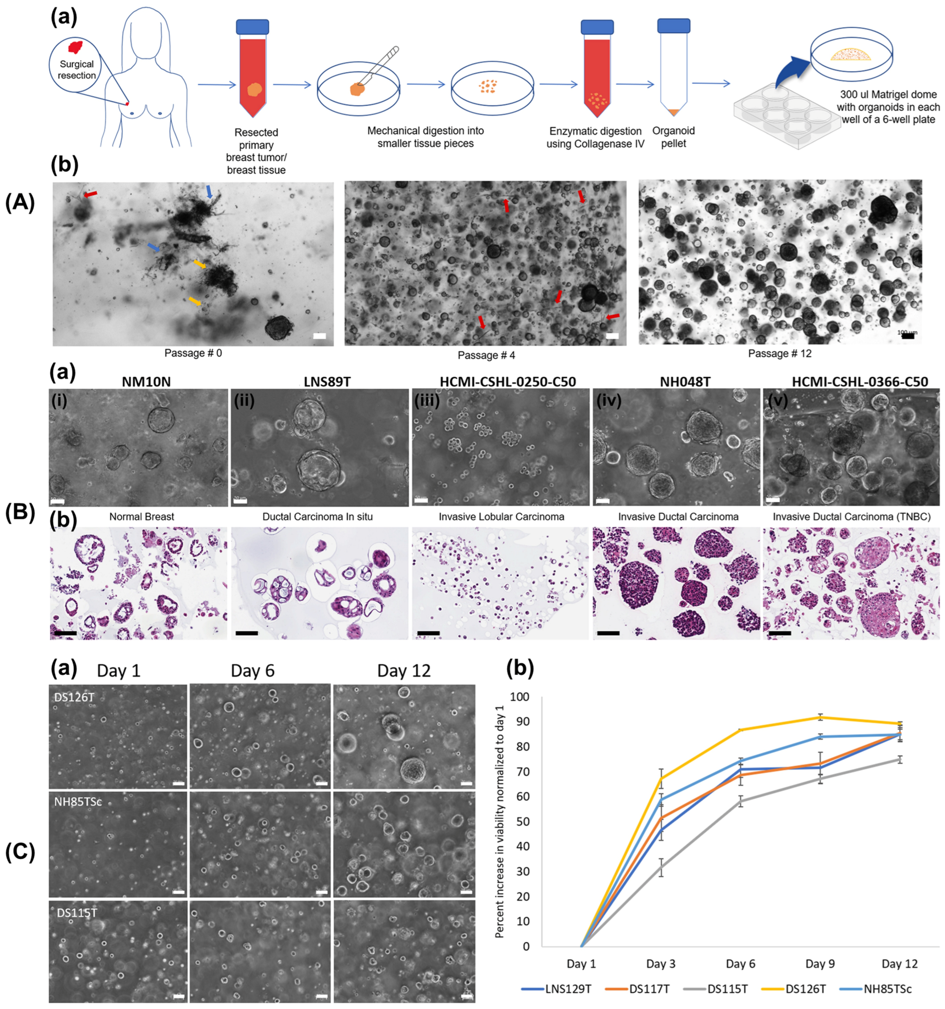 Integrating 3D Bioprinting with Organoid Technology-Based Breast Cancer ...