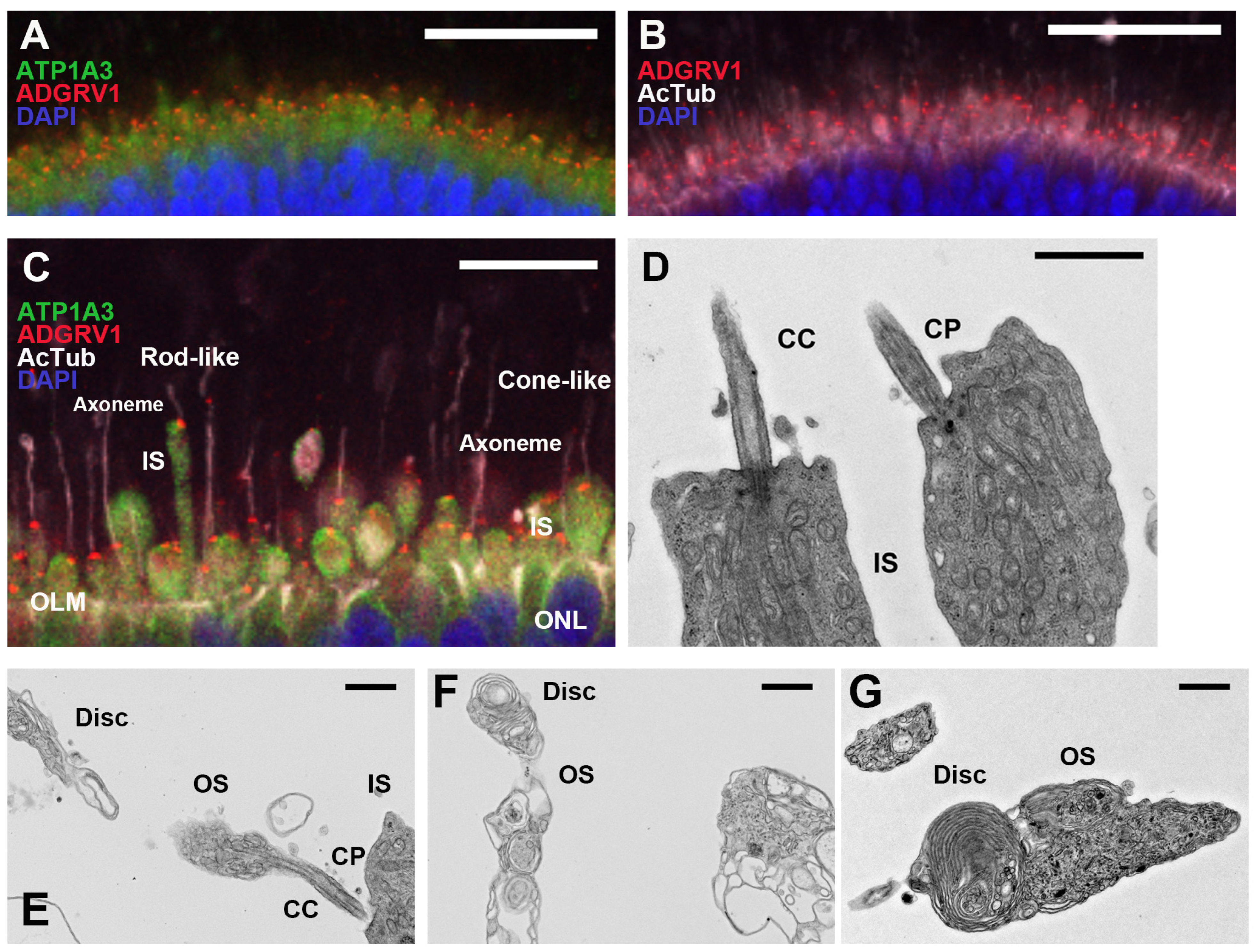 Improved Differentiation of Human Retinal Organoids Producing Mature ...