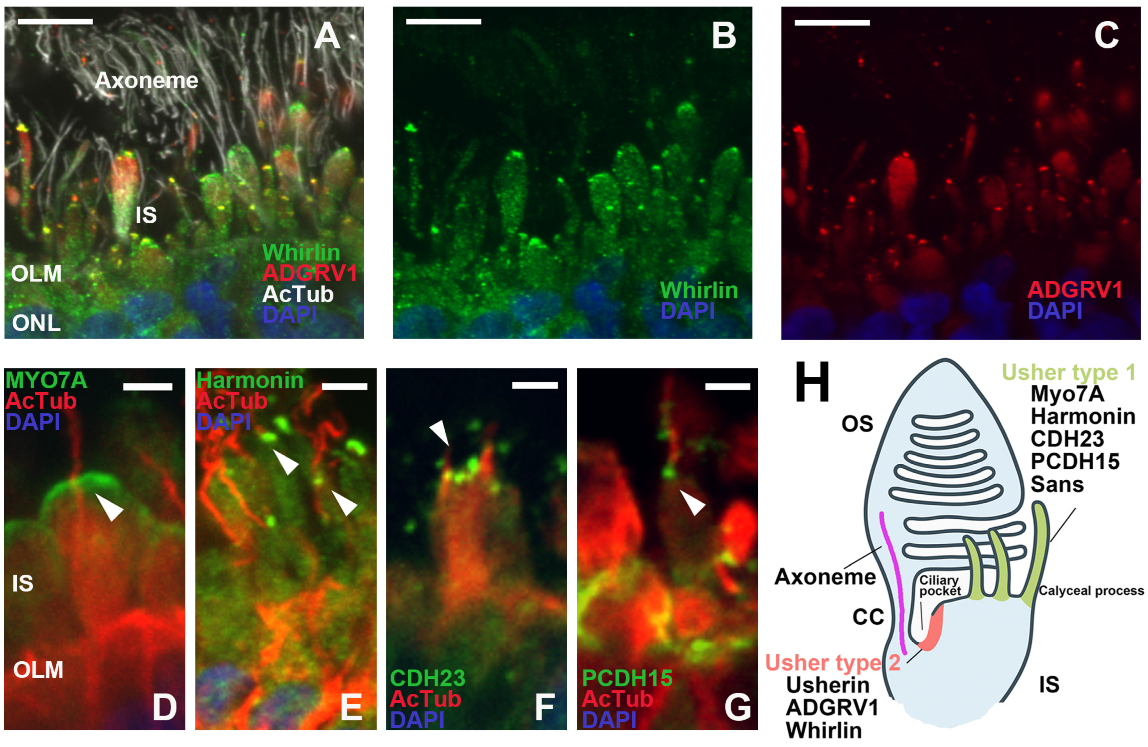 Improved Differentiation of Human Retinal Organoids Producing Mature ...