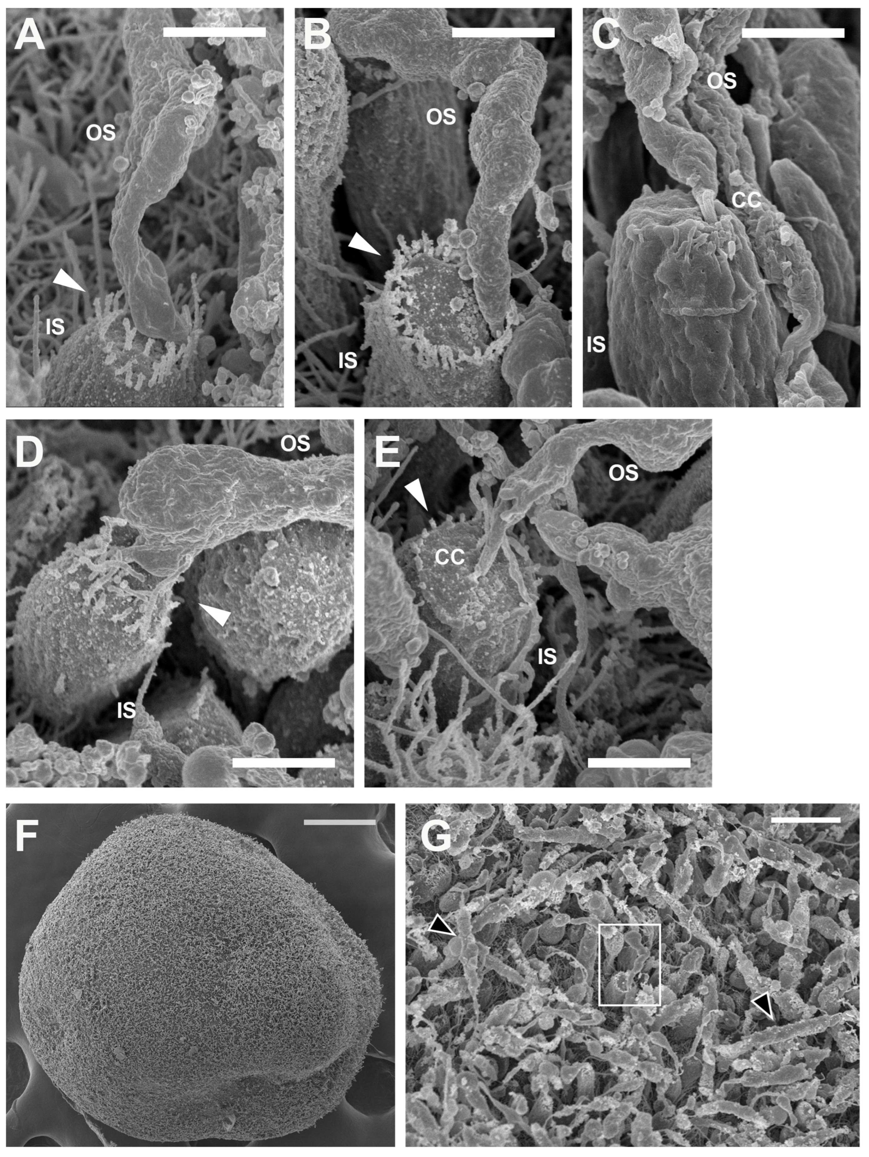 Improved Differentiation of Human Retinal Organoids Producing Mature ...